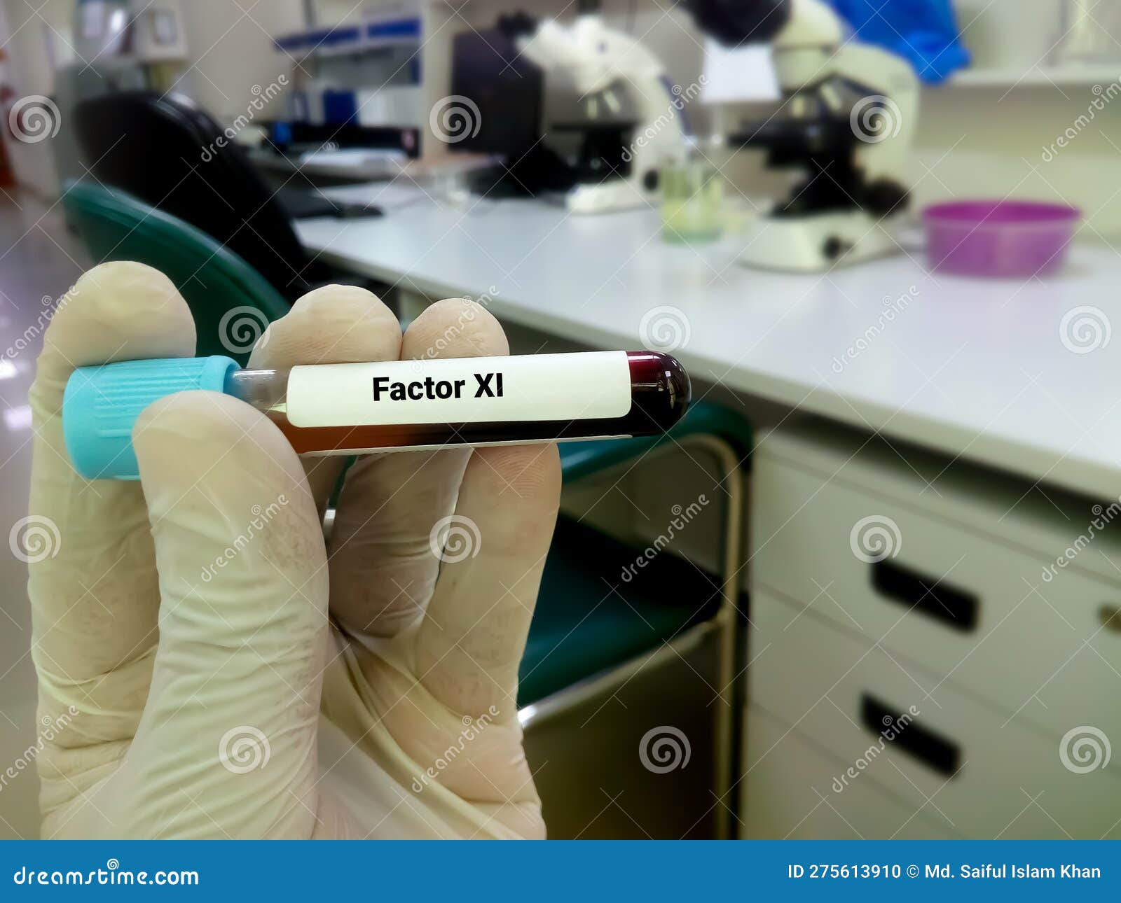 Factor XI or Plasma Thromboplastin Antecedent Diagnosis of Coagulation ...