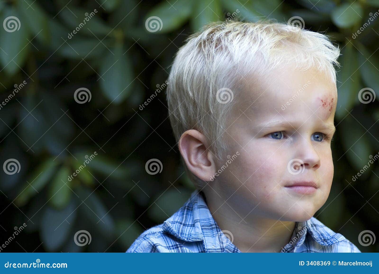 Fallen stock image. Image of injured, emotion, health - 3408369