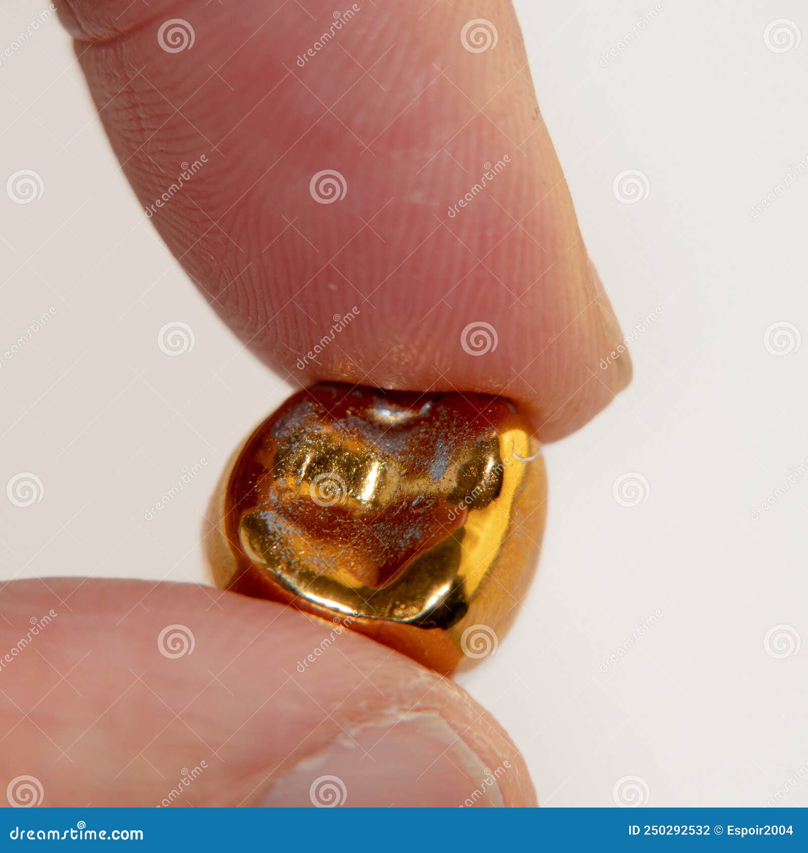 A Fallen Gold Tooth in the Hand of an Elderly Man.. Stock Photo - Image ...