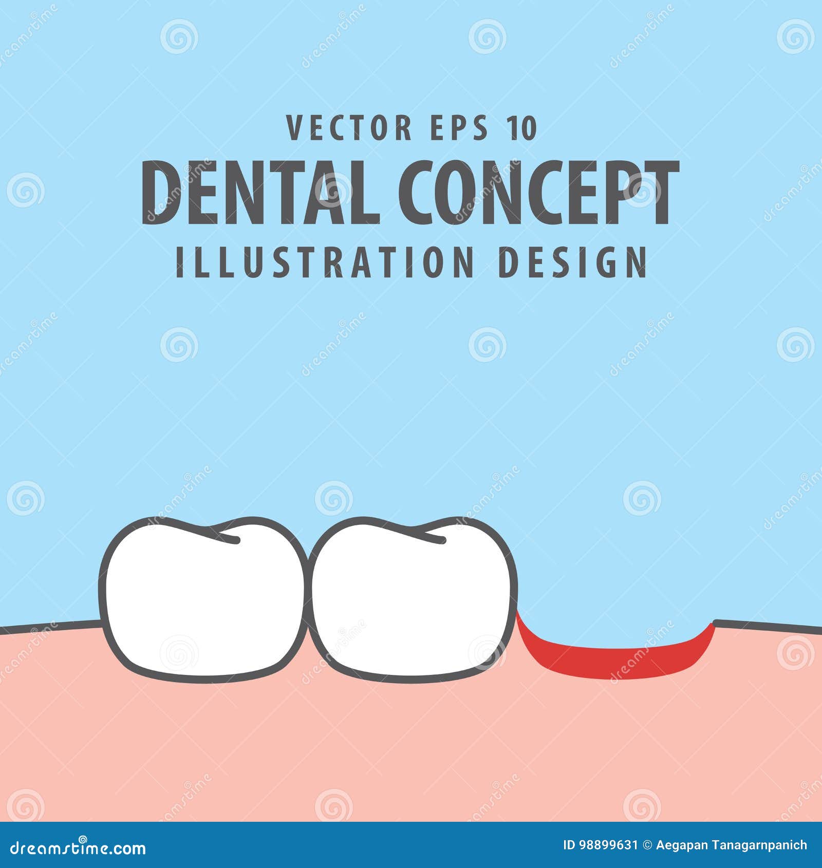 Fallen Tooth Illustration Vector on Blue Background. Dental Concept ...