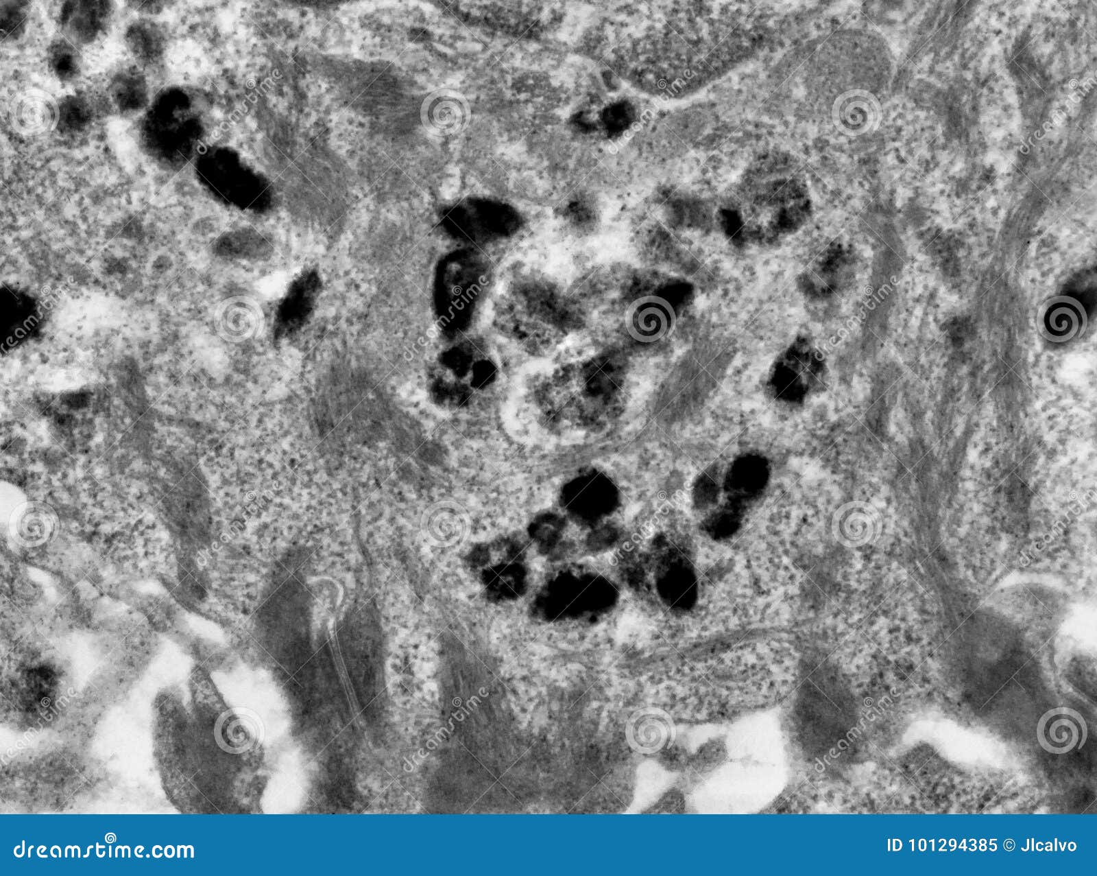 Melanin Granules in Skin Cell, TEM Stock Image - Image of filaments ...