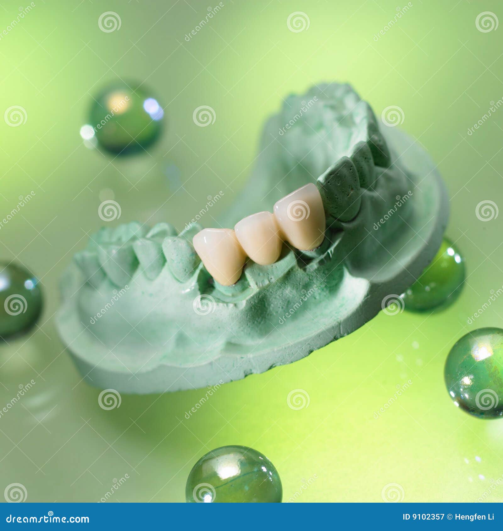 False teeth stock image. Image of clinical, prosthetics - 9102357