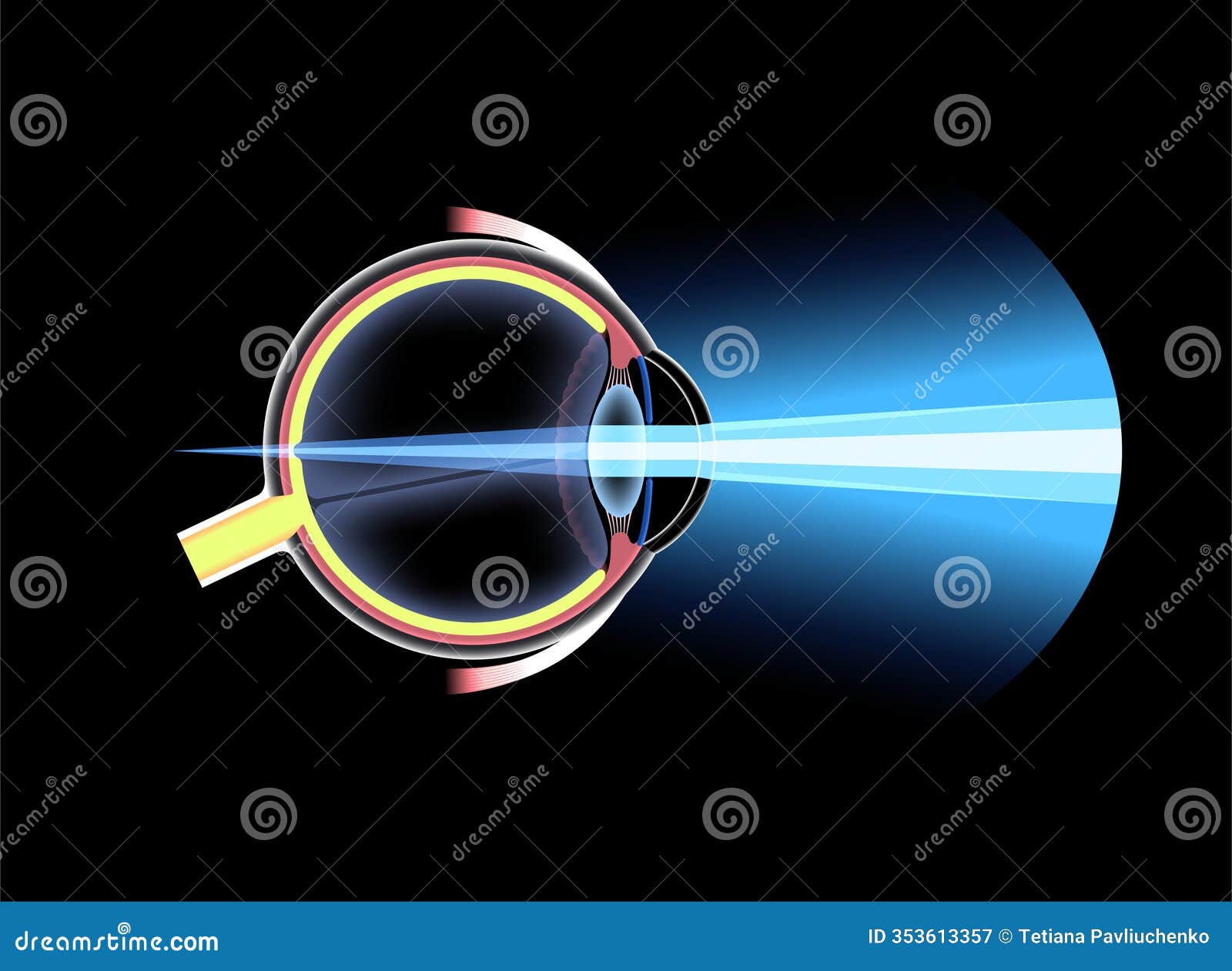 Farsightedness Structure Diagram Medical Science Vector Illustration ...