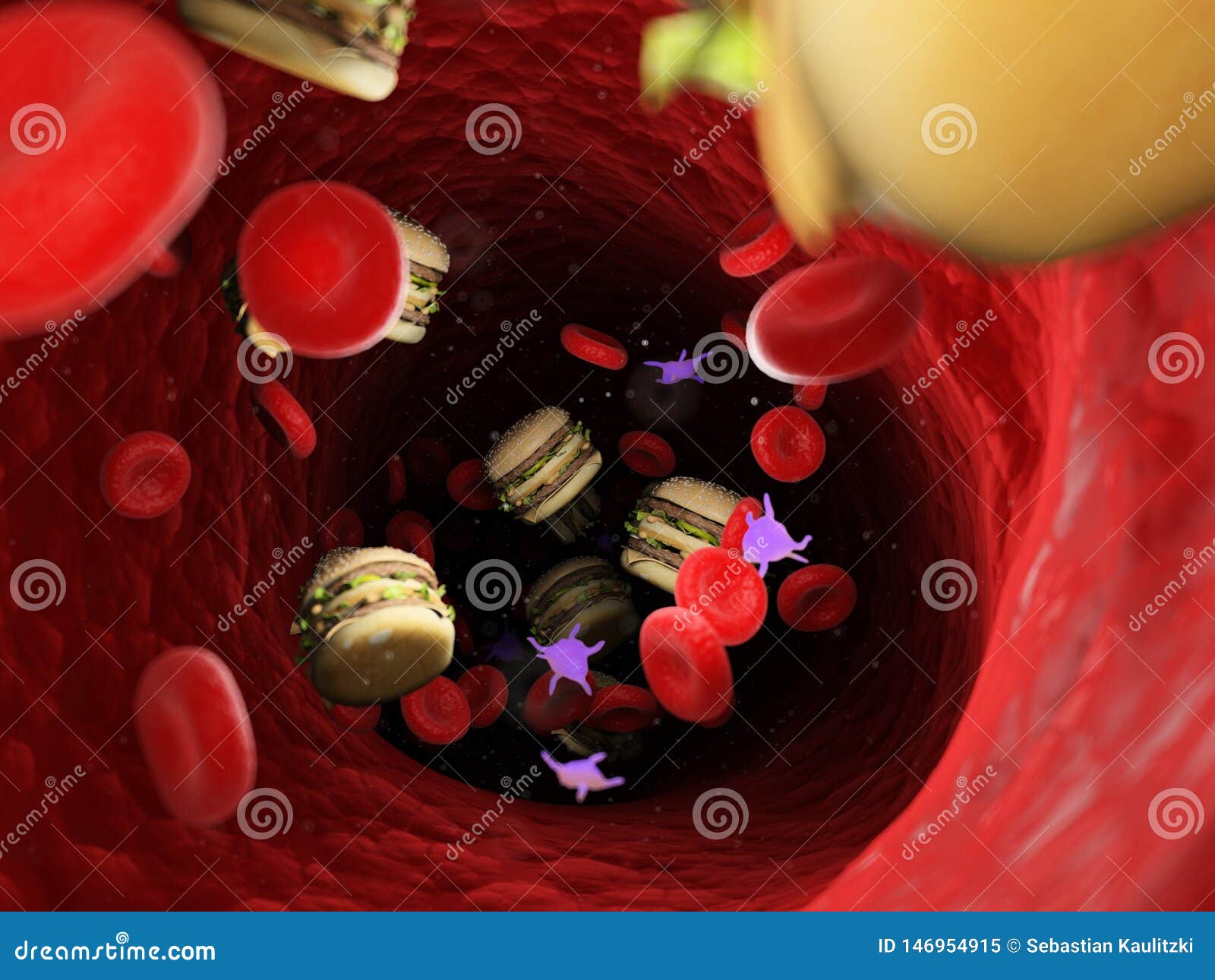Fat in the blood stream stock illustration. Illustration of cancer ...