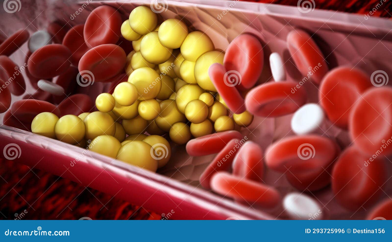 Fat Cells Blocking the Blood Flow Inside Human Vein. 3D Illustration ...