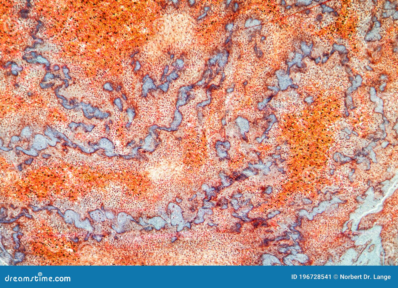 Fat Heart Tissue Under the Microscope Stock Image - Image of ...