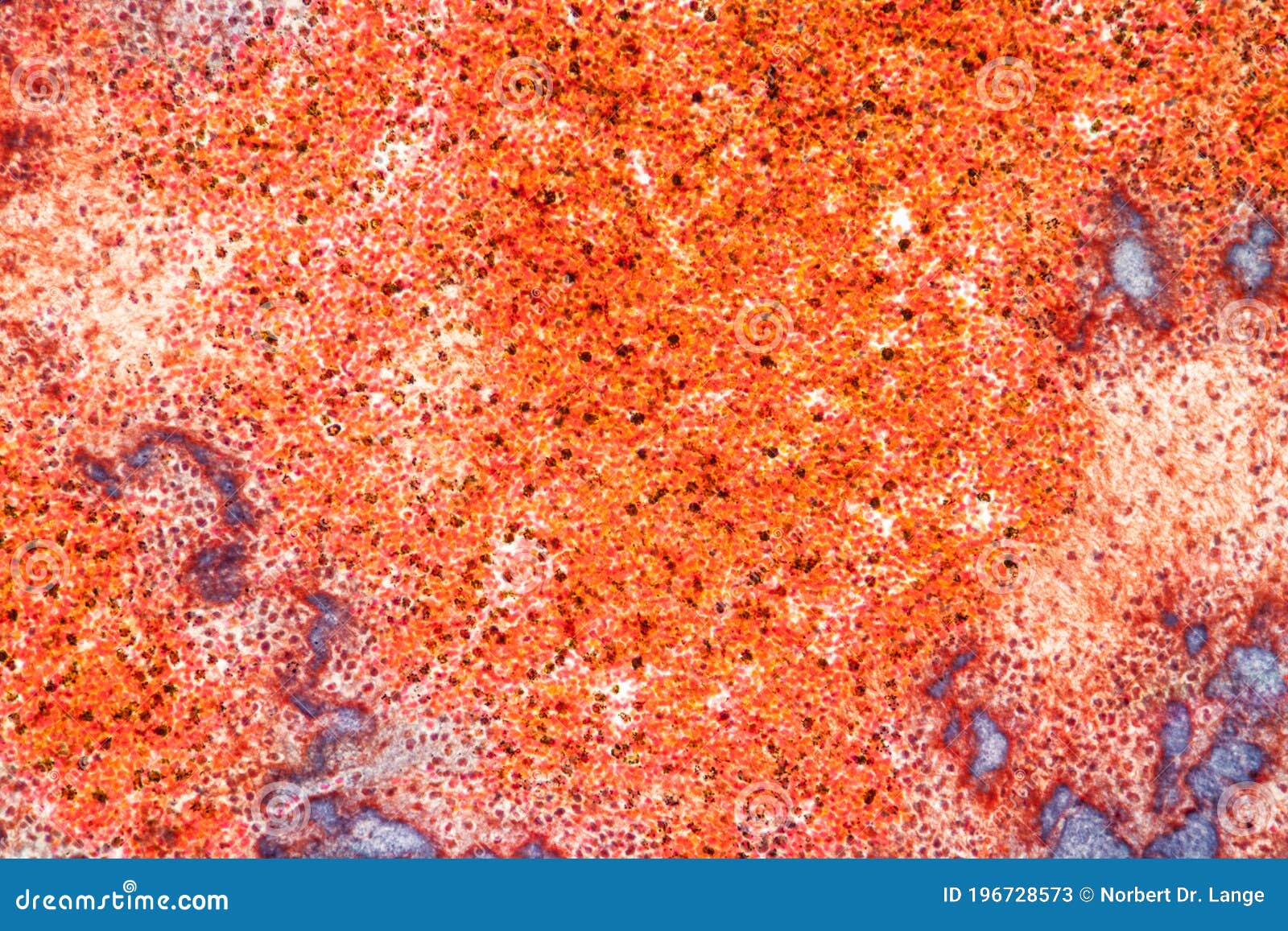 Fat Heart Tissue Under the Microscope Stock Image - Image of macro ...