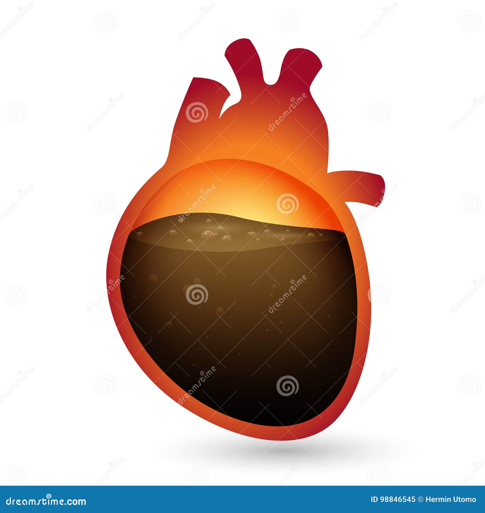 Fat in the Heart stock vector. Illustration of artery - 98846545