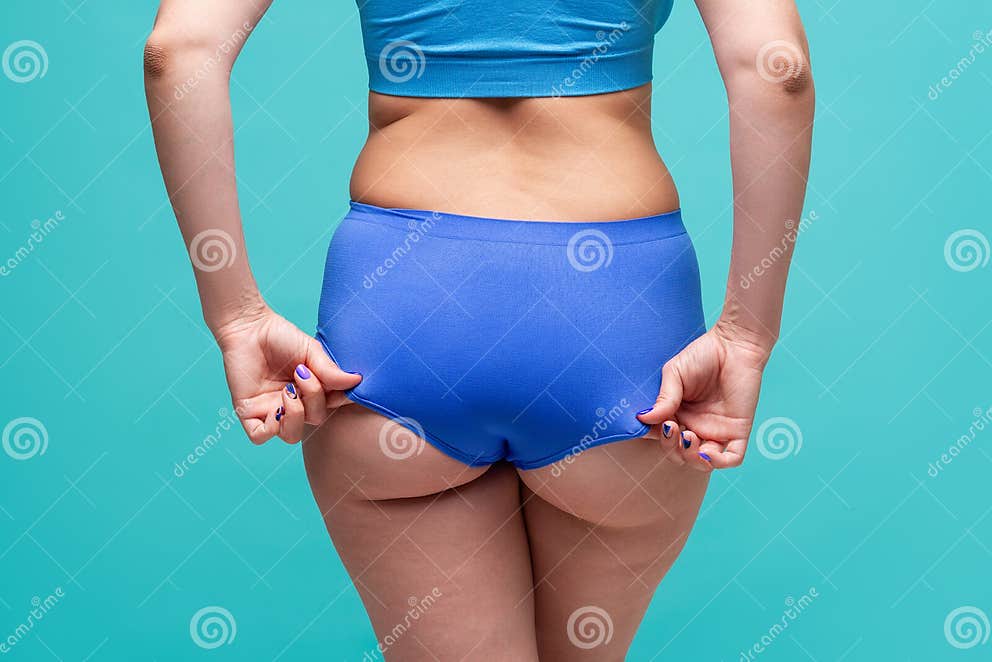 Fat Hips And Buttocks Obesity Female Body On Blue Background Stock Image Image Of Cellulite