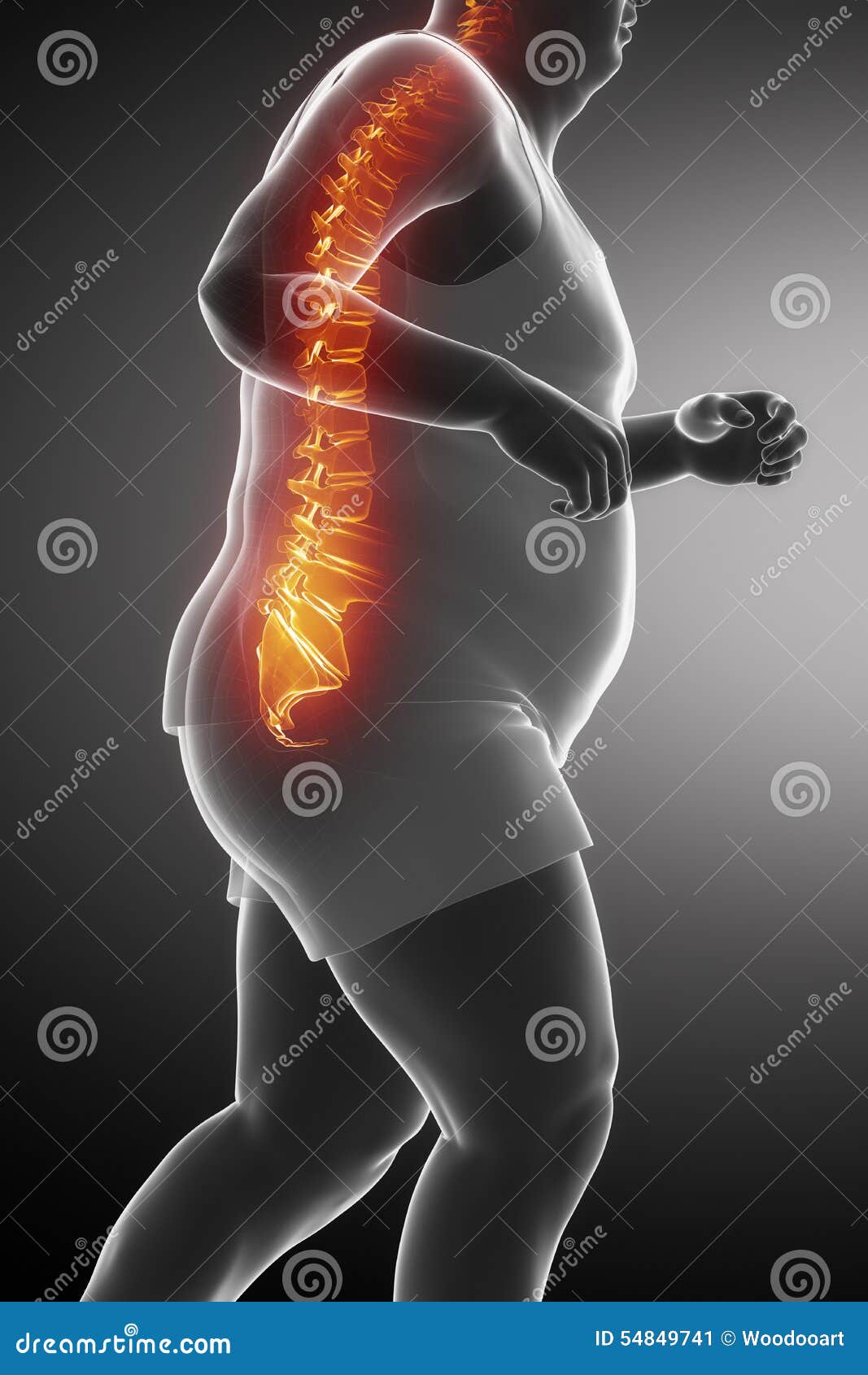 Fat man with backache stock illustration. Illustration of overweight ...