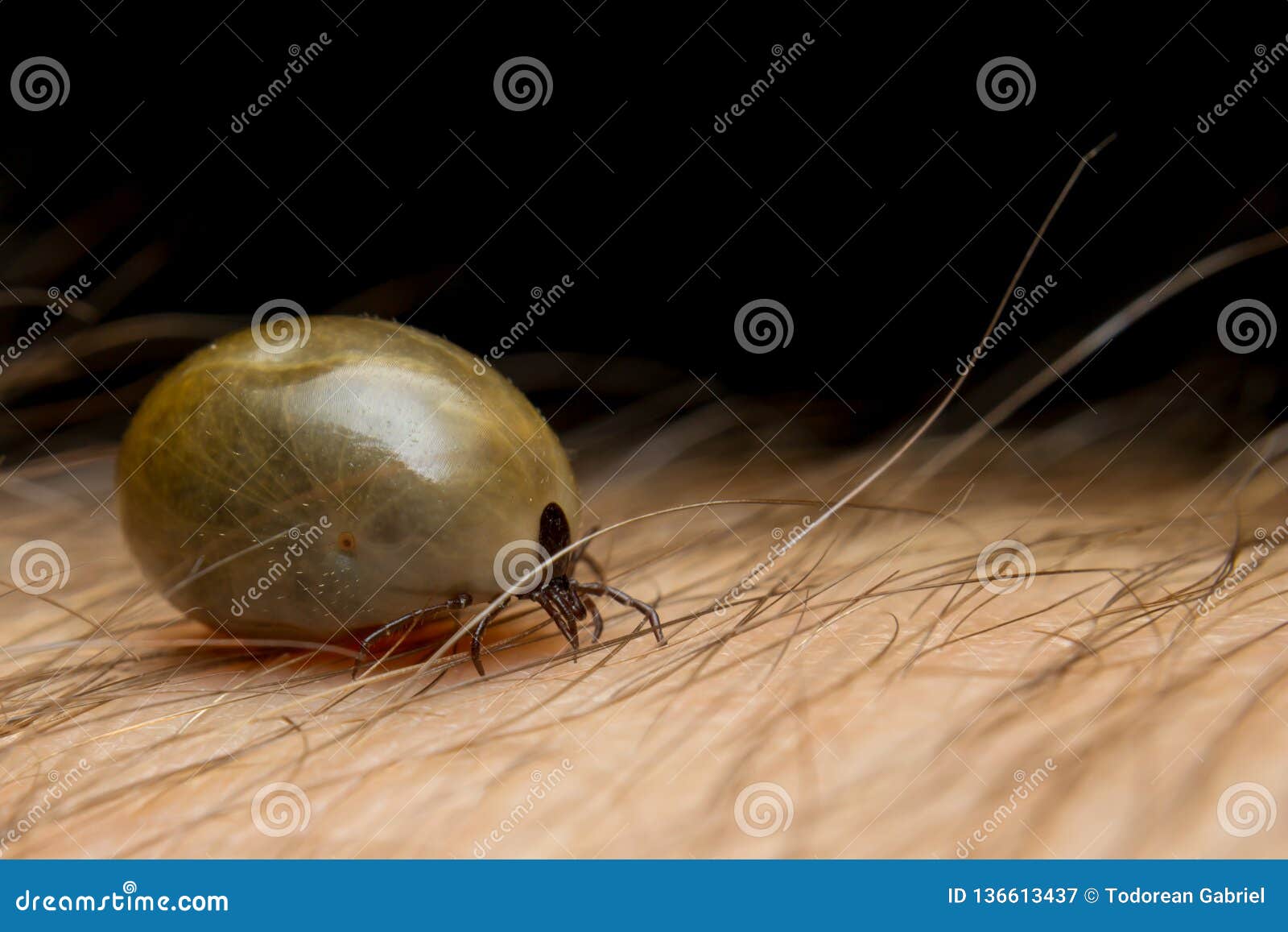 Tick on skin surface stock image. Image of tick, surface - 136613437