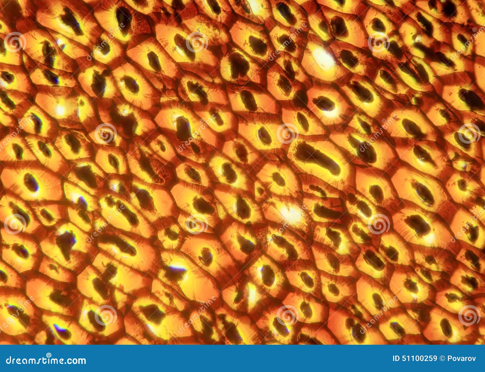 Fatia De Plasmodesmata Sob O Microscópio, (segundo De Plasmodesma ...