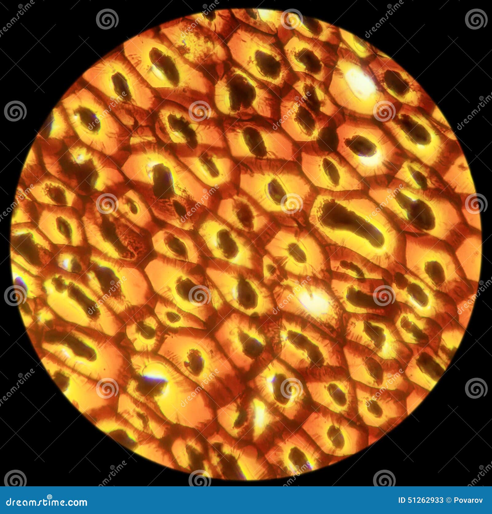 Fatia De Plasmodesmata Sob O Microscópio, (segundo De Plasmodesma ...