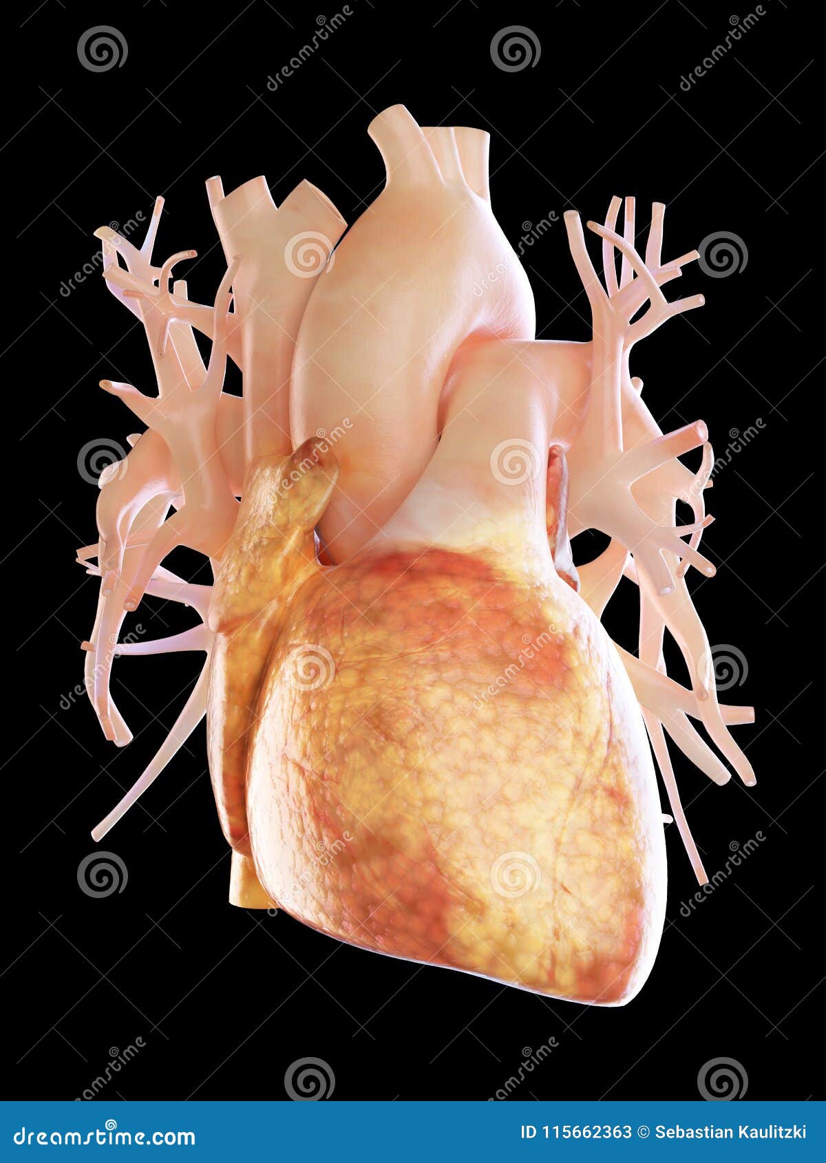 A fatty heart stock illustration. Illustration of graphic - 115662363
