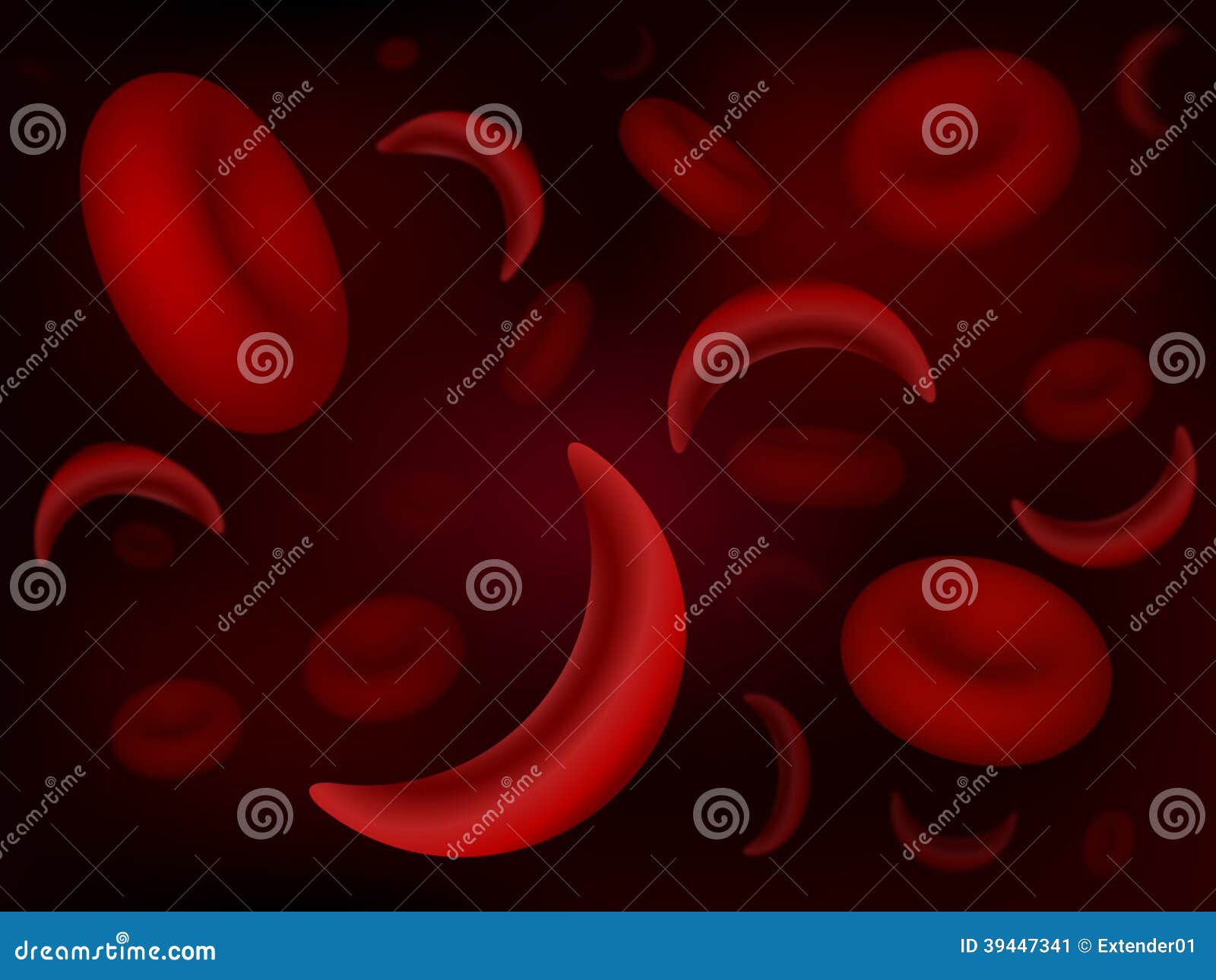 Faucille-cellule Et Globules Rouges Normales Illustration Stock ...