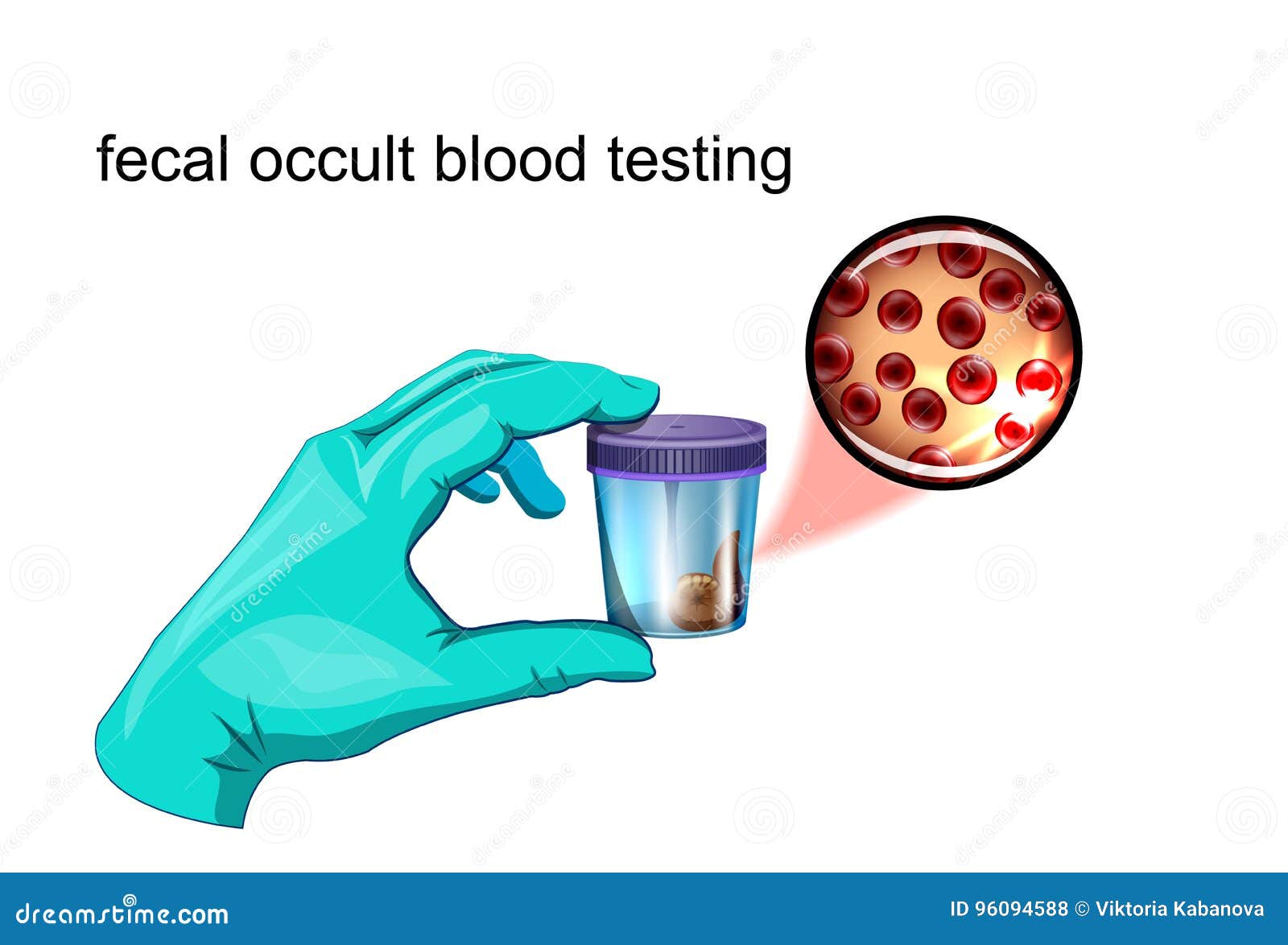 Analysis Fecal Stock Illustrations – 72 Analysis Fecal Stock ...