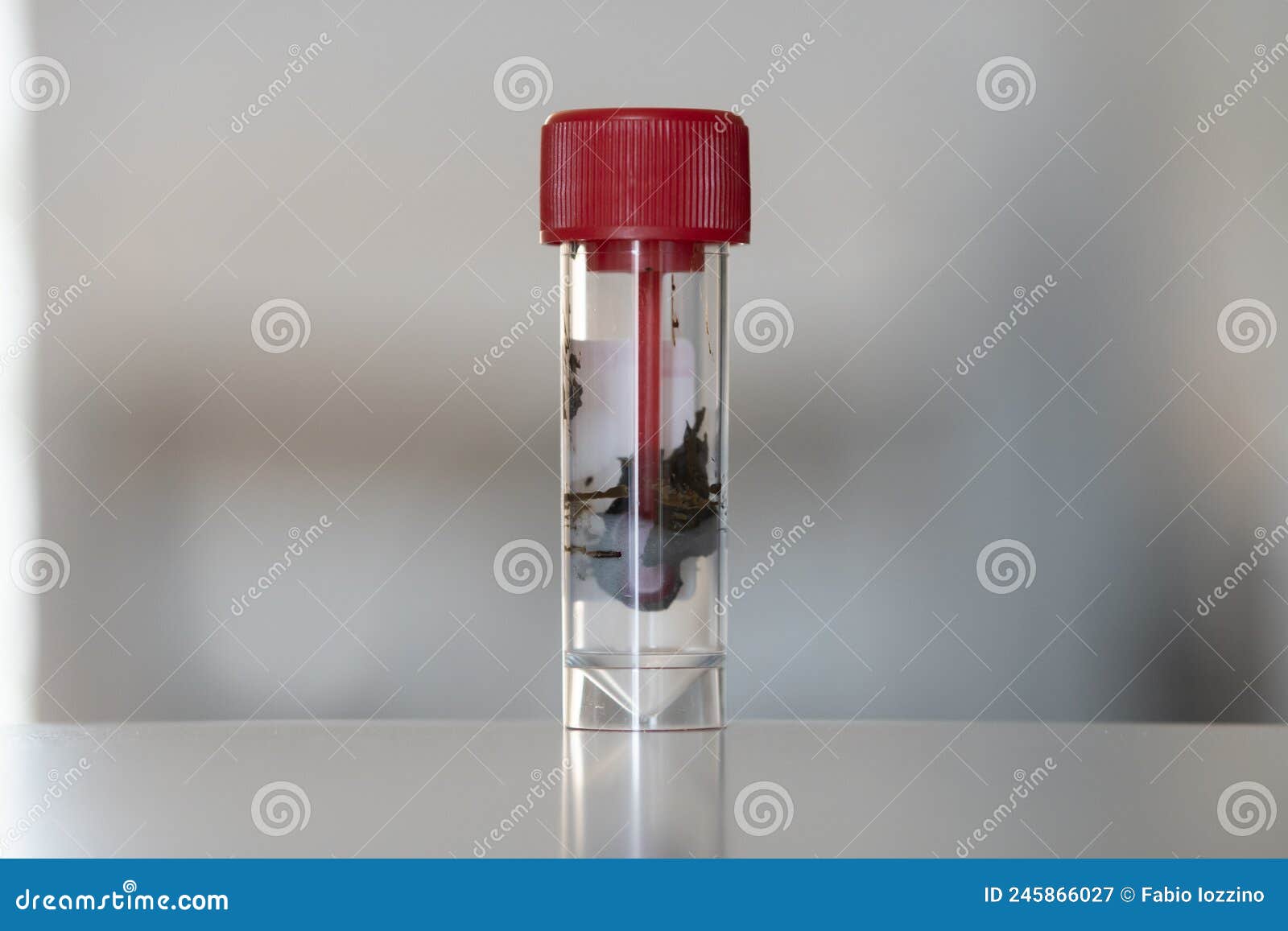 Feces Collected in Stool Examination Container for Human Stool Analysis ...