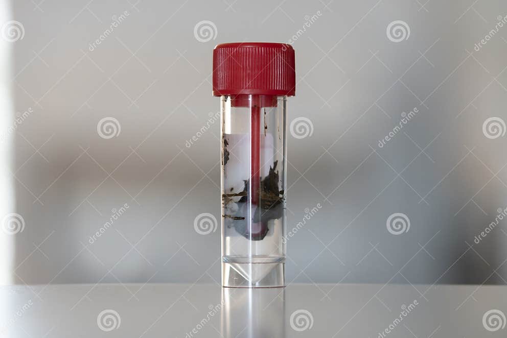 Feces Collected in Stool Examination Container for Human Stool Analysis ...