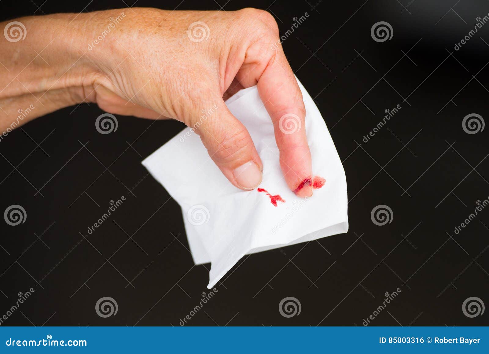 Feche Acima Do Dedo Ensanguentado Da Ferida Do Corte Isolado Foto de ...