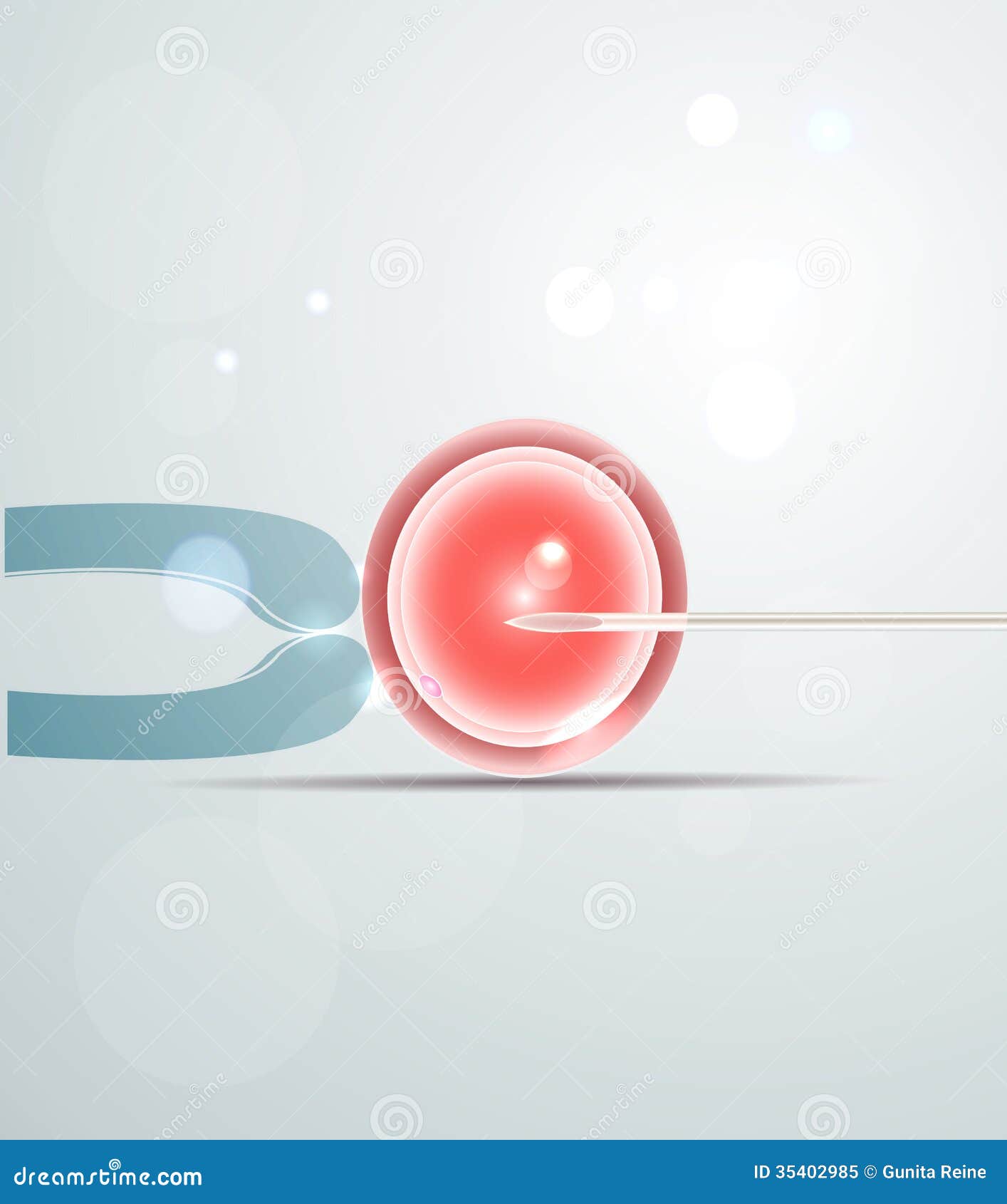 Fecondazione artificiale illustrazione vettoriale. Illustrazione di ...