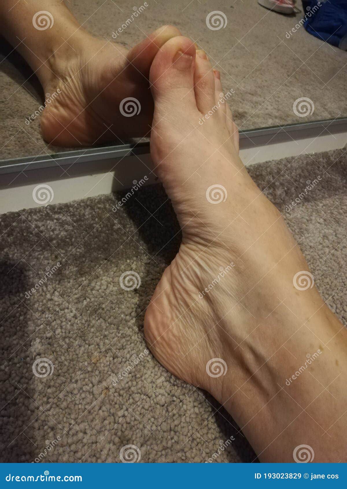 Foot And Toes Injury X-ray Scan Orthopedics And Traumatology Radiology ...