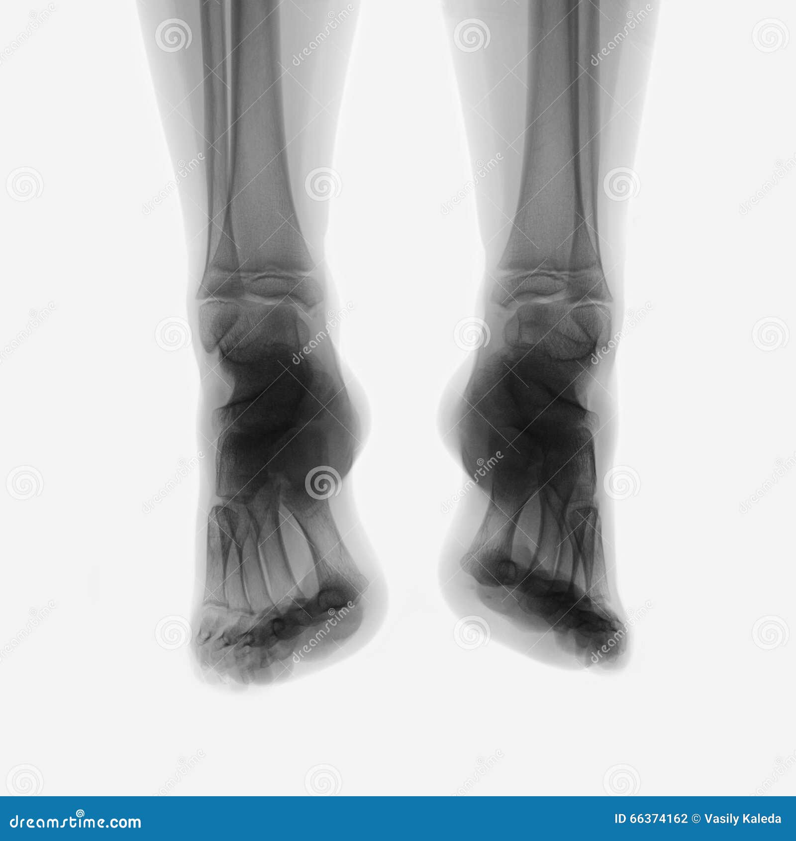 Feet stock photo. Image of footstep, medical, isolated - 66374162