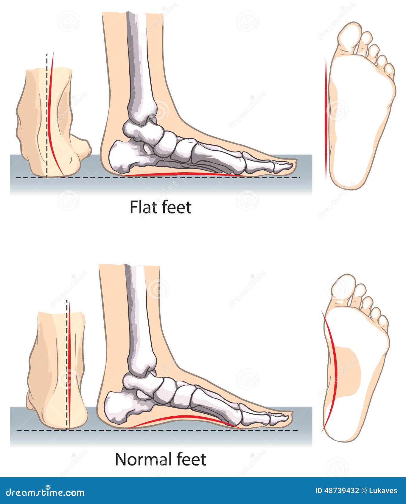 Feet stock vector. Illustration of medical, footprint - 48739432