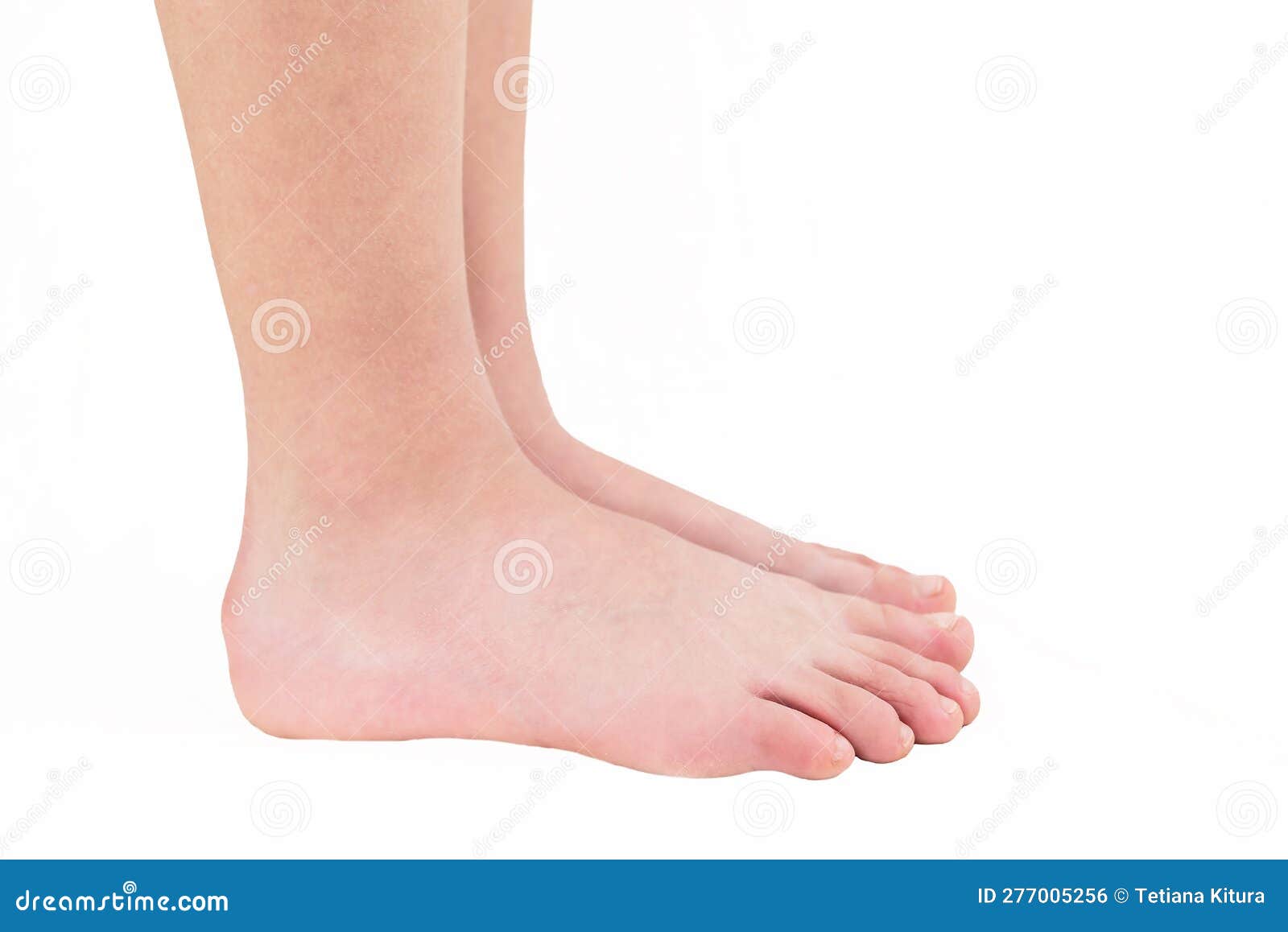 Feet on white stock photo. Image of human, chiropody - 277005256