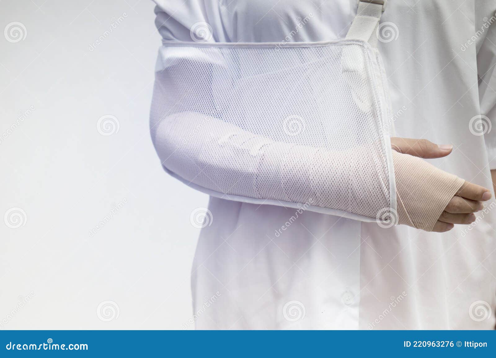 Female Broken Arm and Wear Arm Splint Stock Photo - Image of orthopedic ...