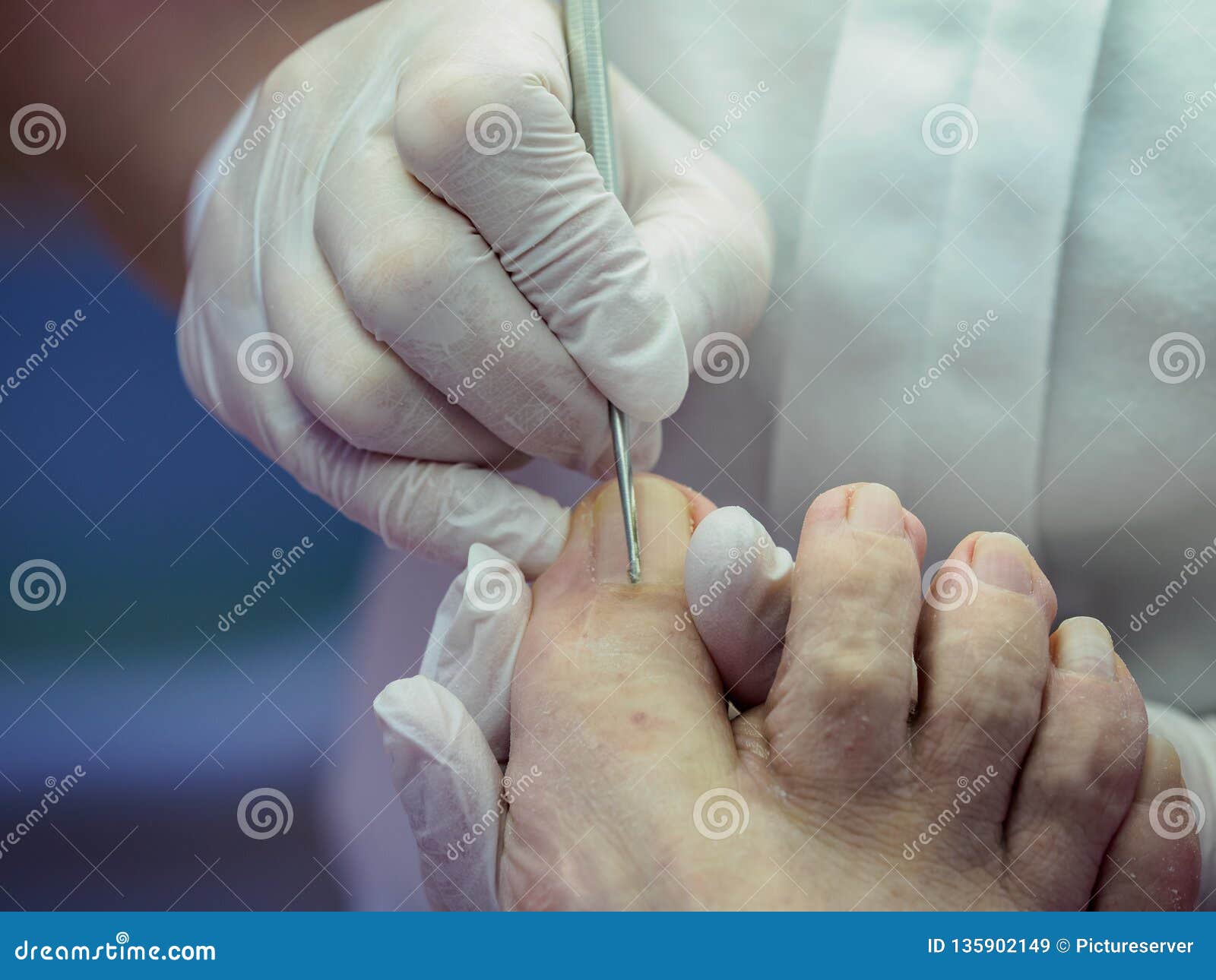 Female Chiropodist Working on a Senior Clients Feet Stock Image - Image ...