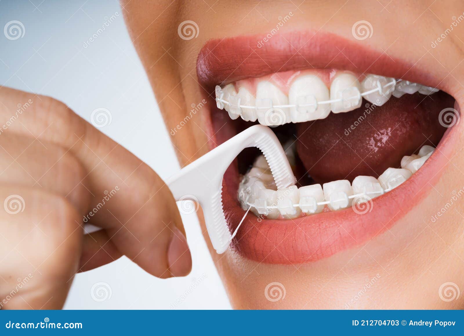 Female Cleaning Dental Brackets in Mouth Stock Image - Image of clean ...