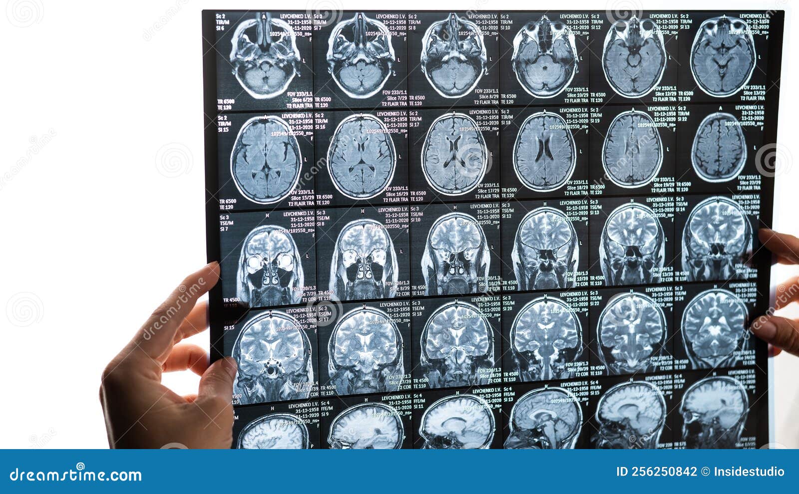 A Female Doctor Examines an MRI Scan of the Brain. Stock Photo - Image ...