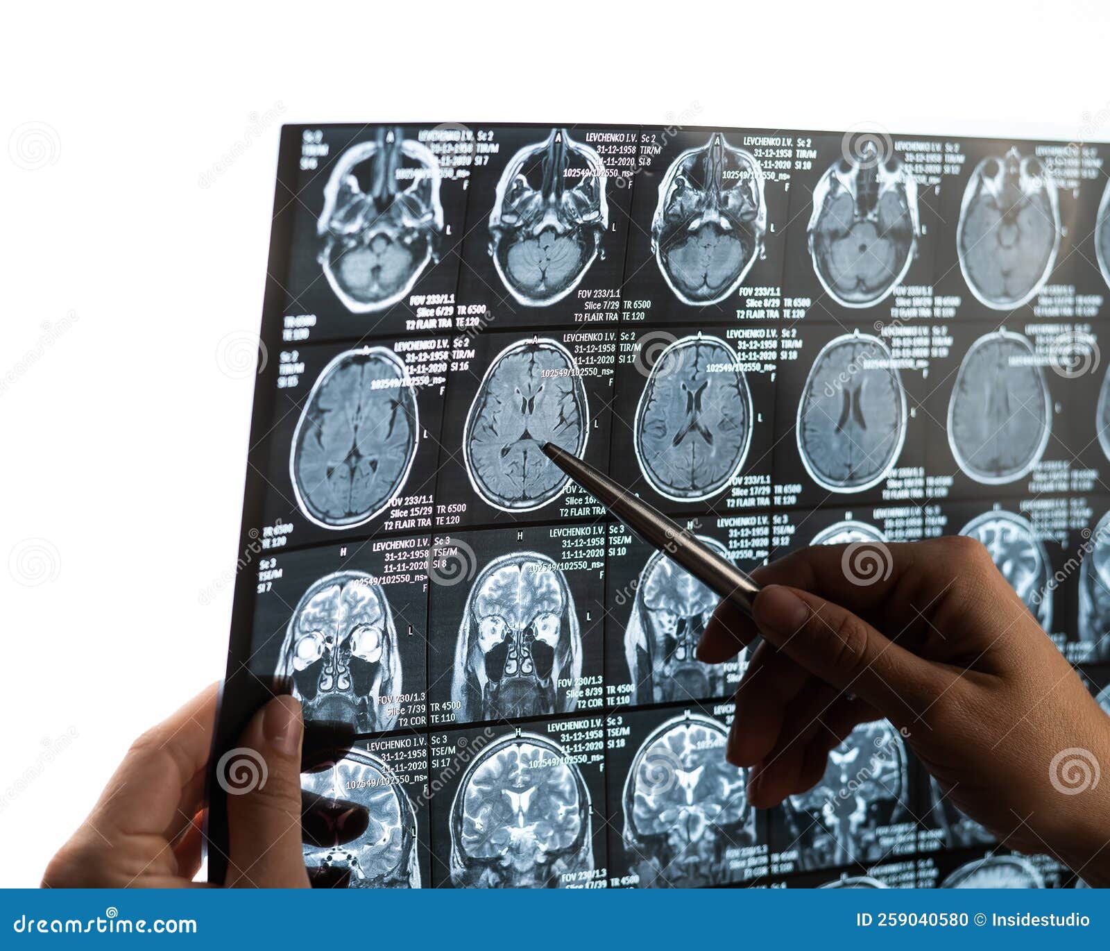 A Female Doctor Examines an MRI Scan of the Brain. Stock Photo - Image ...