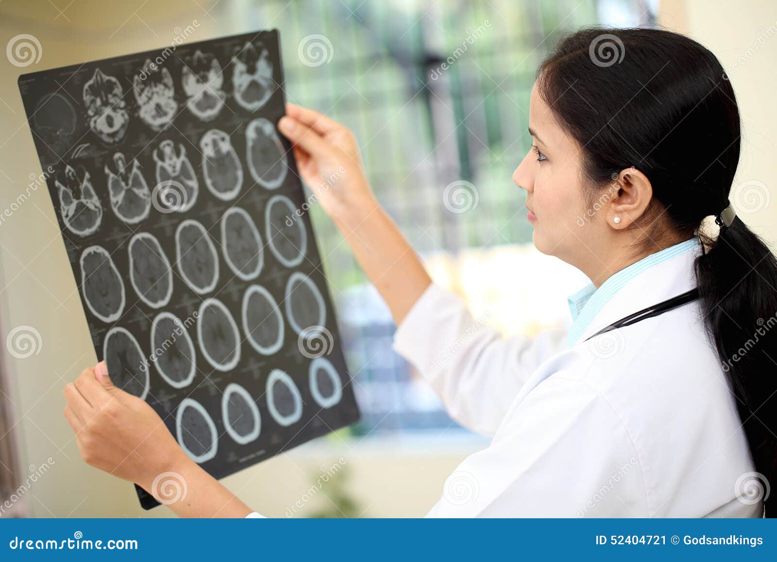 Female Doctor Examining a Brain Scan Stock Image - Image of medicine ...