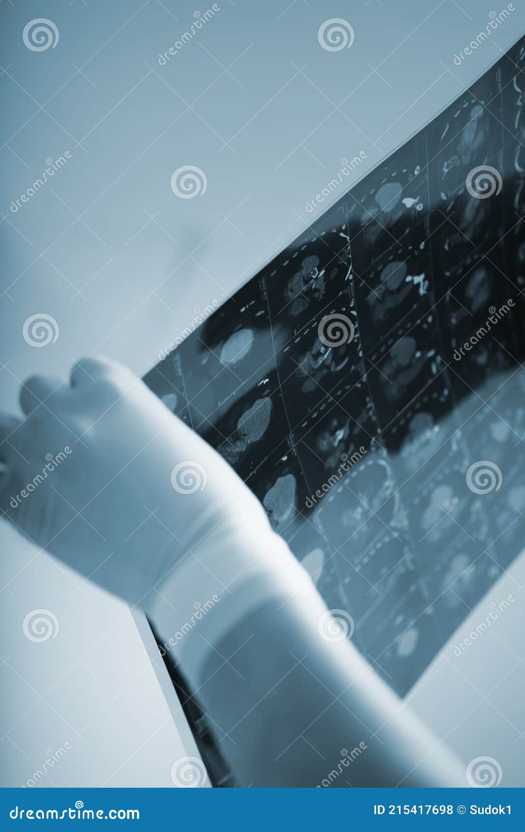 Female Doctor Holding the CT Scan in the Gloved Hand Stock Photo ...