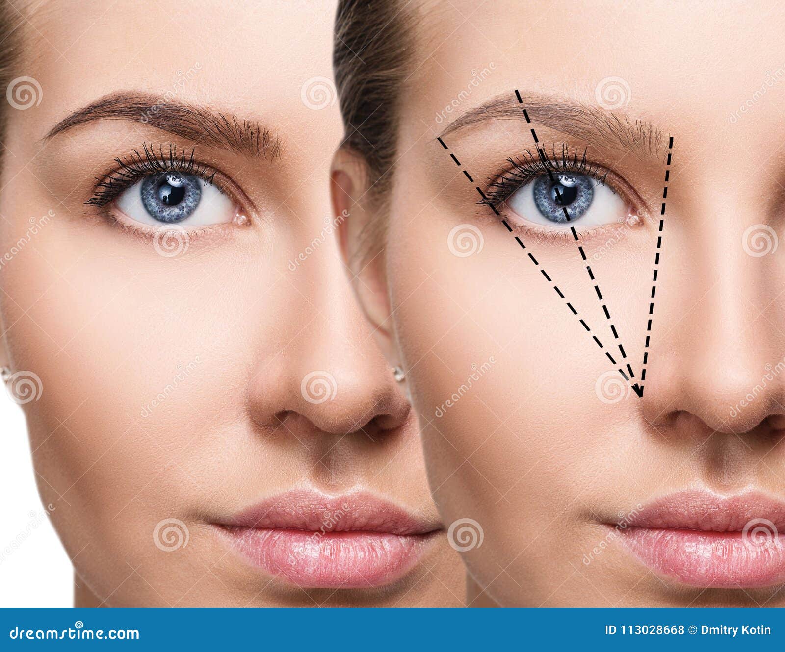 Female Face before and after Eyebrows Correction. Stock Photo - Image ...