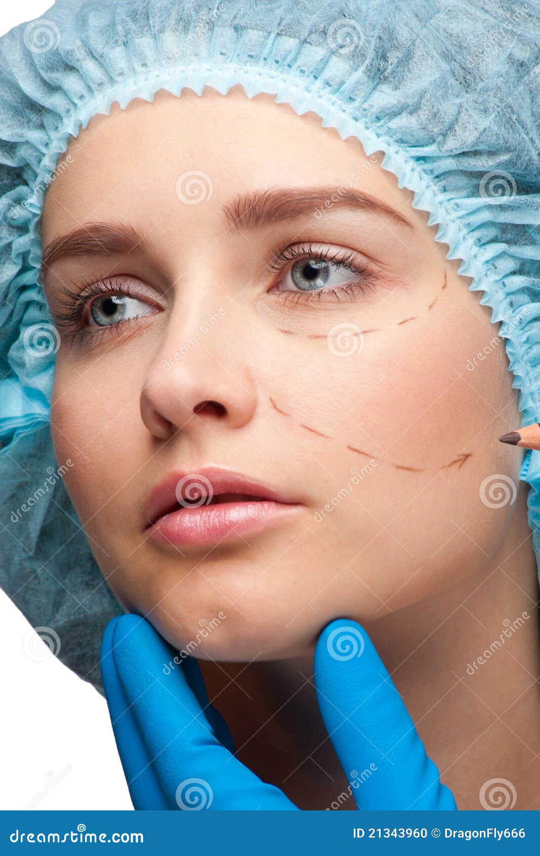 Female Face before Plastic Surgery Operation Stock Photo - Image of ...