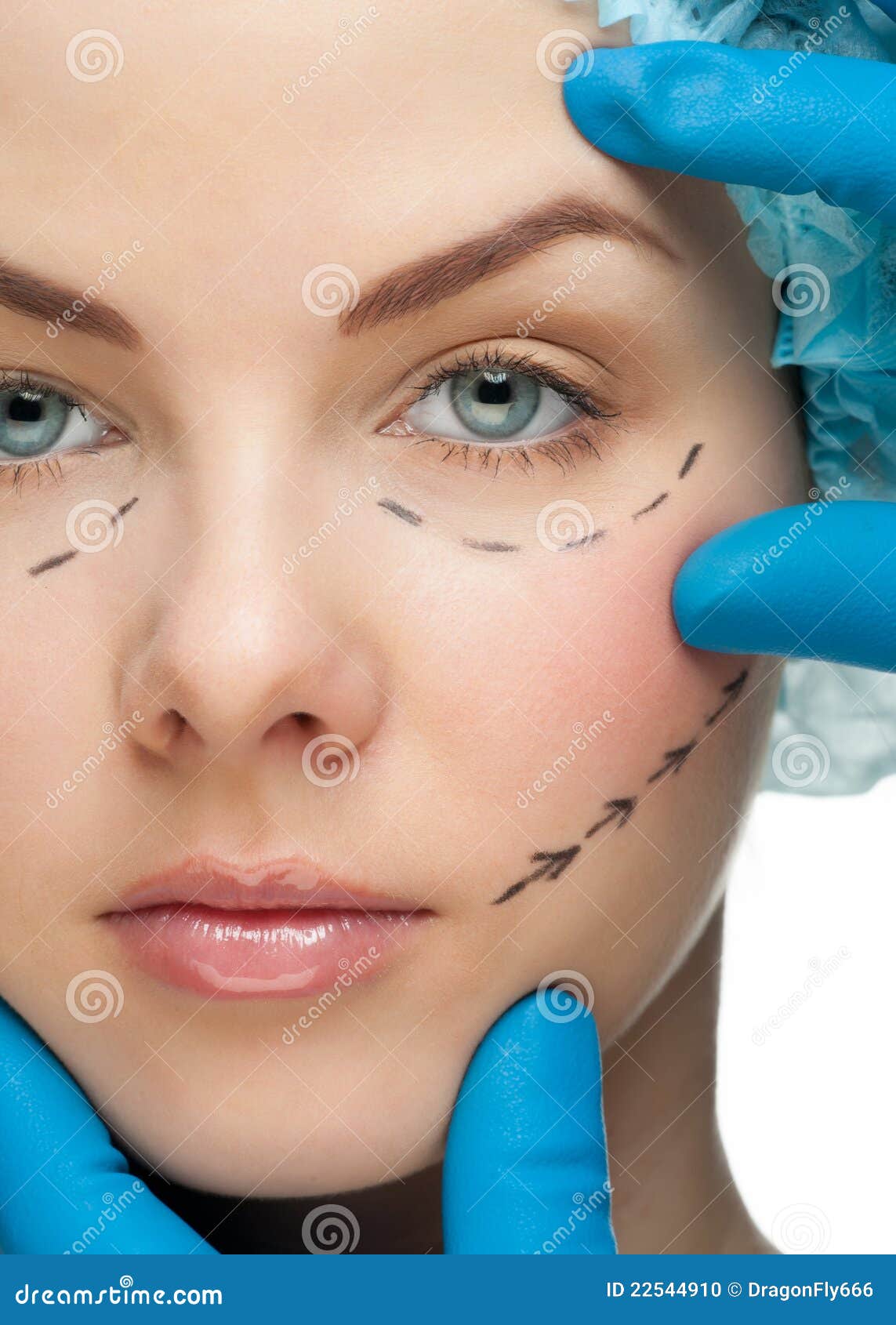 Female Face before Plastic Surgery Operation Stock Photo - Image of ...