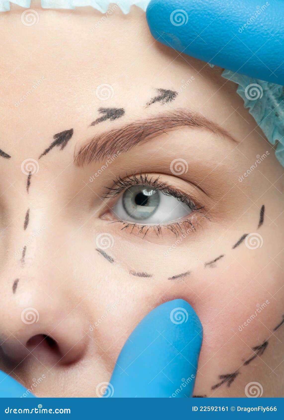 Female Face before Plastic Surgery Operation Stock Image - Image of ...