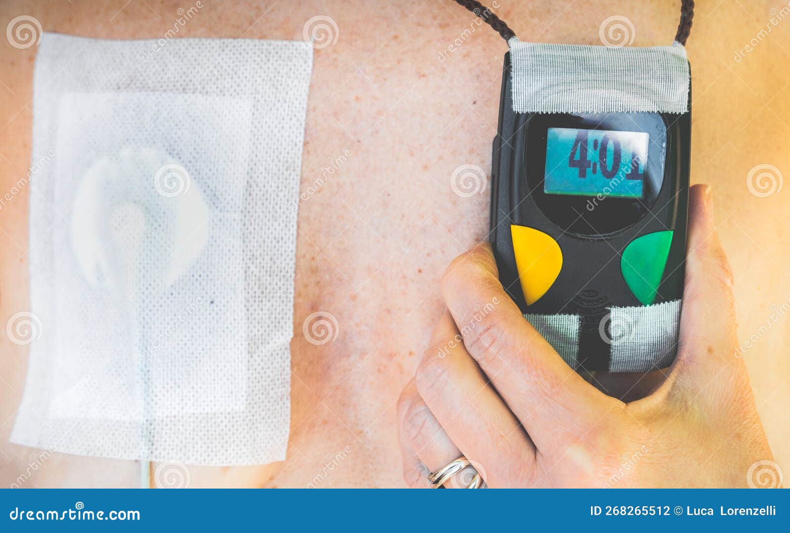 Hand Holter Ecg Device Patch Stock Photo - Image of hold, measurement ...