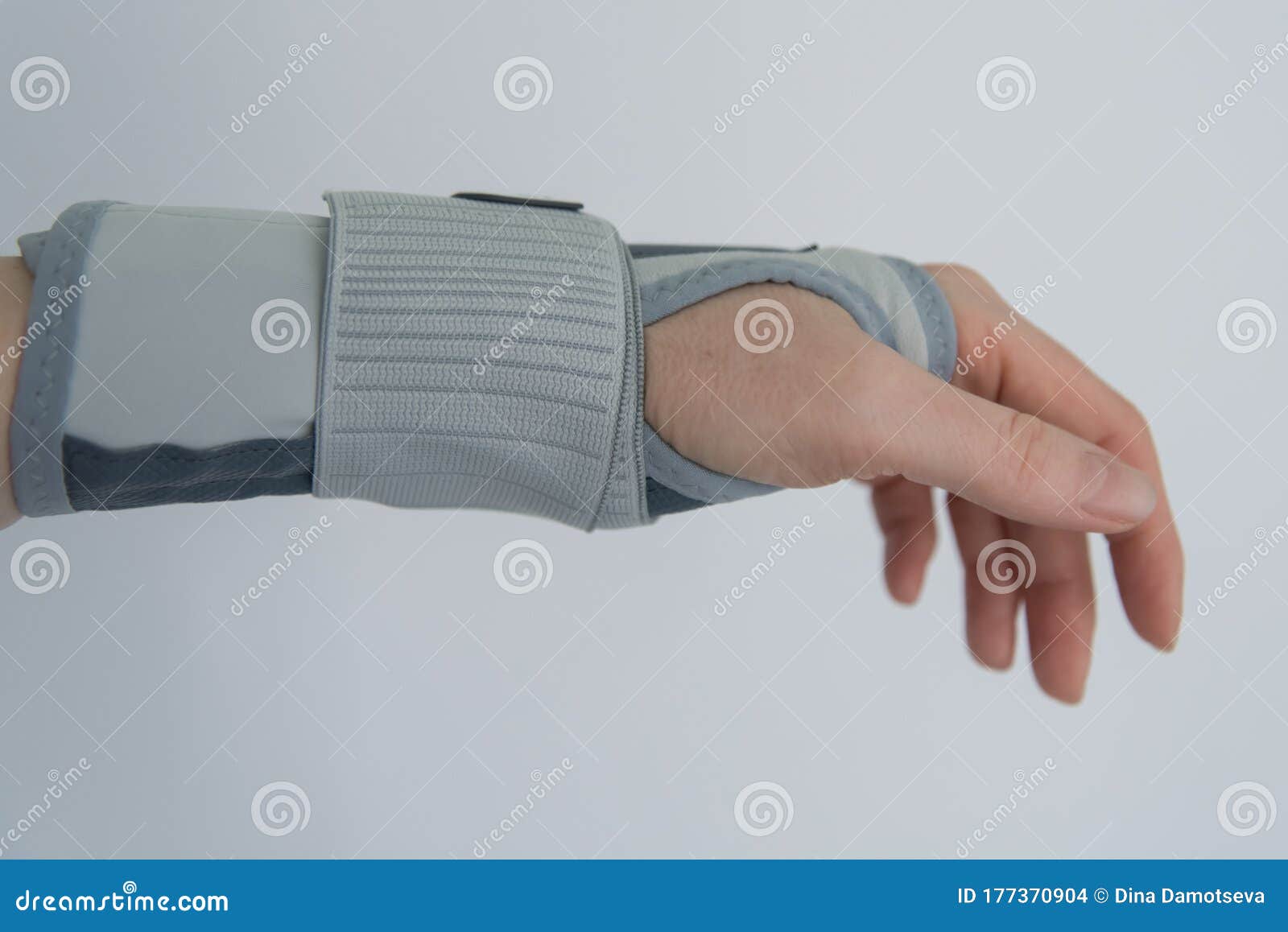 Female Hand with Orthosis, Recovery and Treatment with Modern Orthosis ...