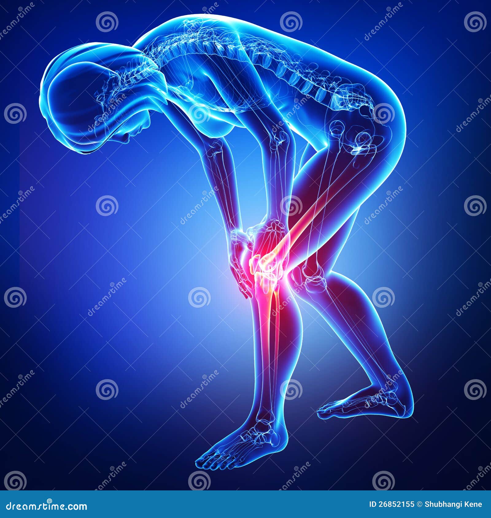 Female Knee and Joints Pain in Blue Stock Illustration - Illustration ...