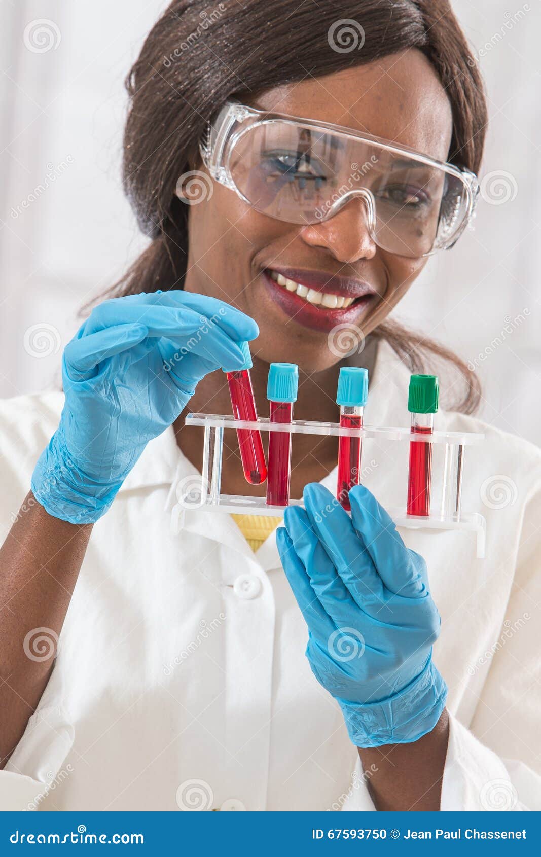 Female Lab Assistant Studying Blood Sample for Analysis Stock Photo ...