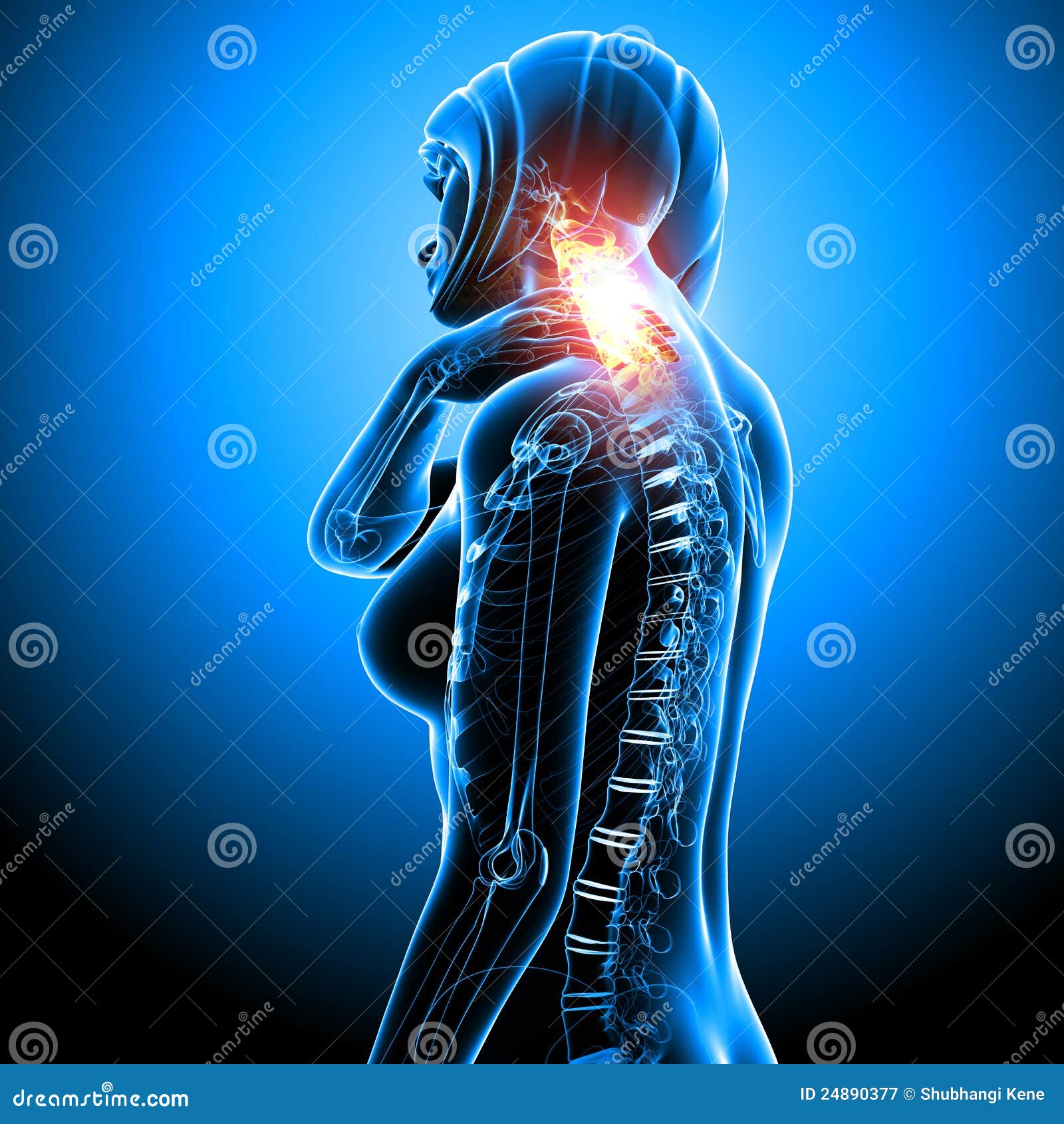 Pain In The Neck X-ray Scan Rear View Royalty-Free Stock Image ...