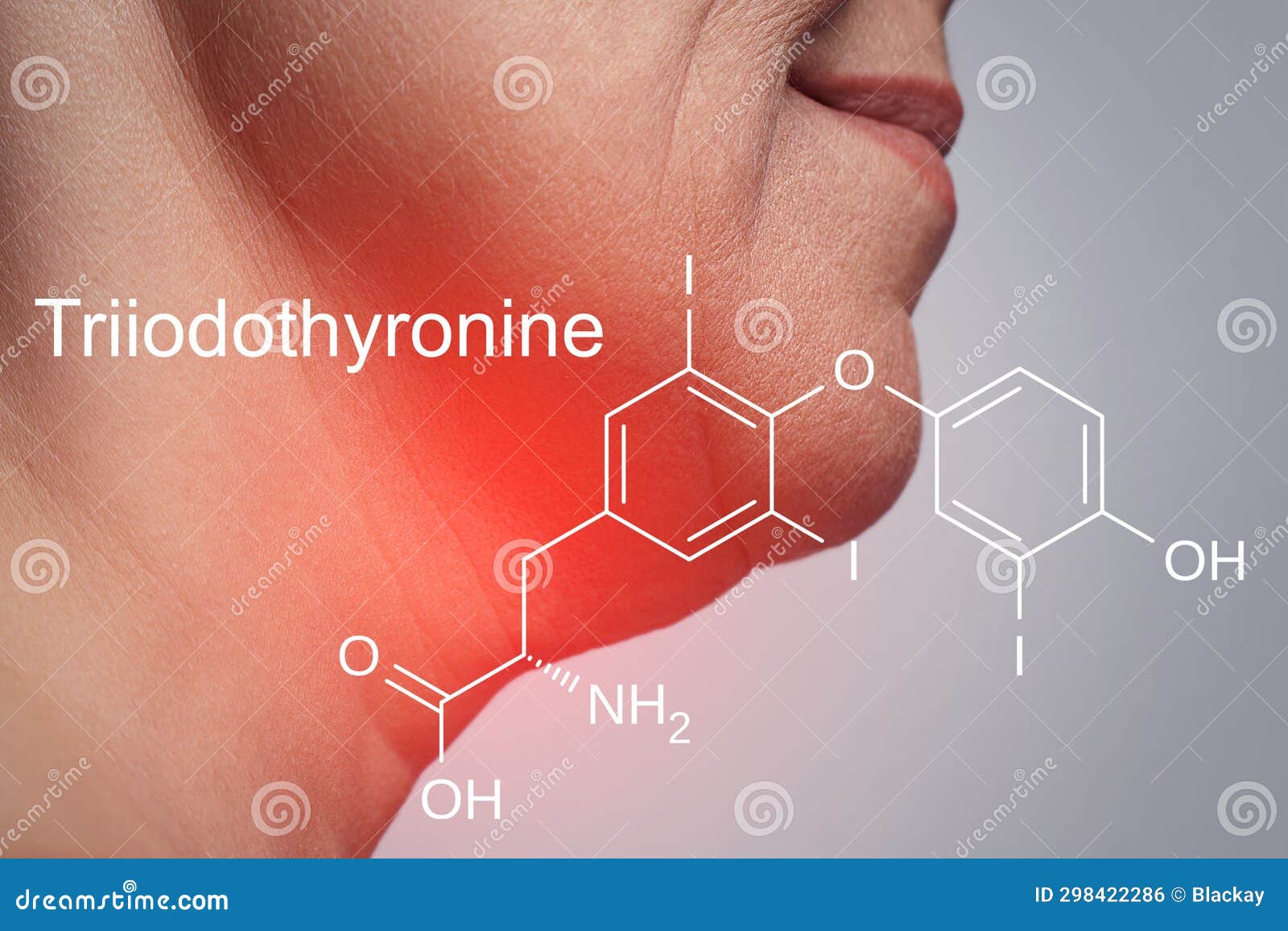 Female Neck and Triiodothyronine Hormone Formula Stock Illustration ...