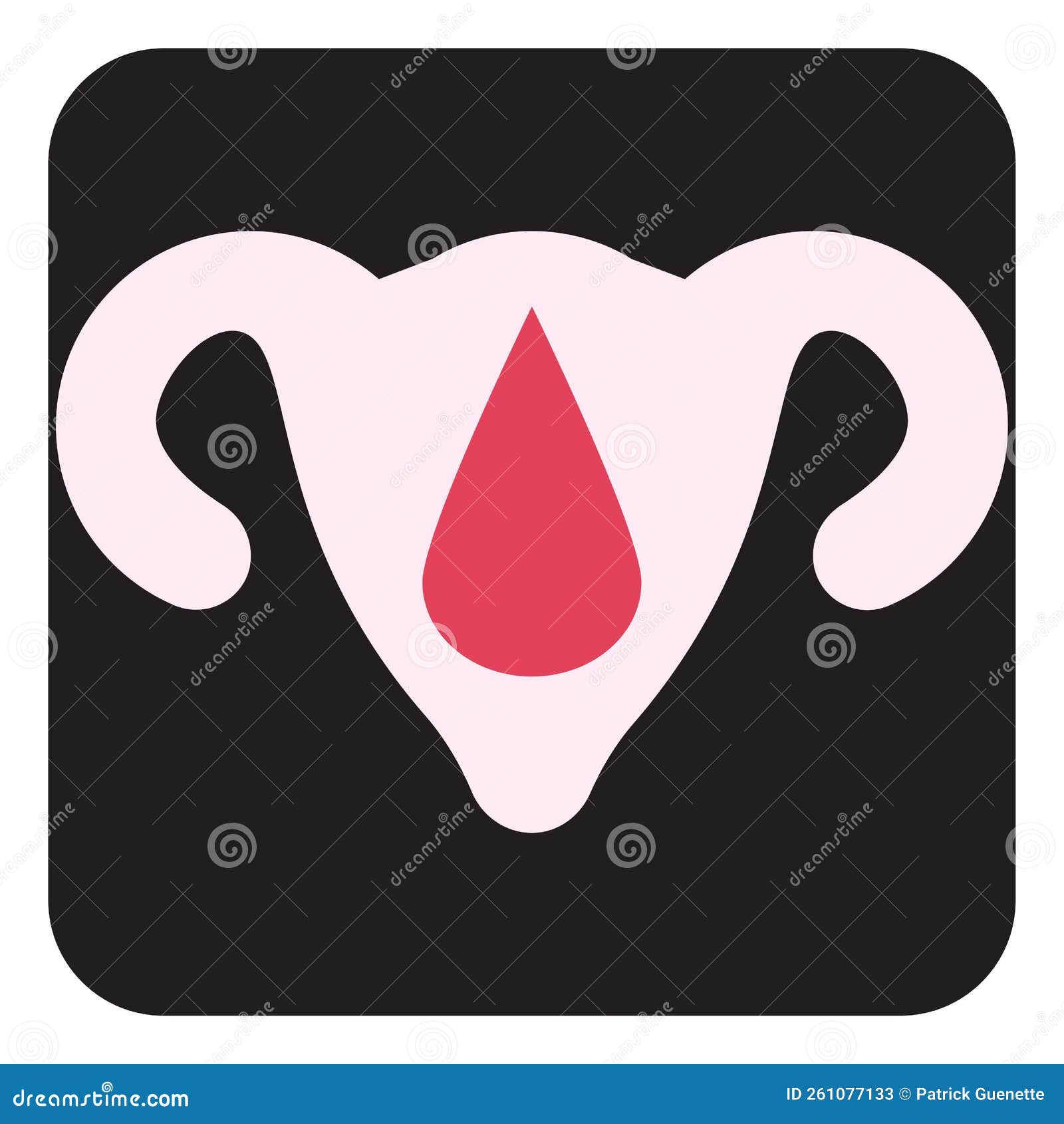 Female Organ Tumor Disease Fibroid- Cartoon Vector | CartoonDealer.com ...