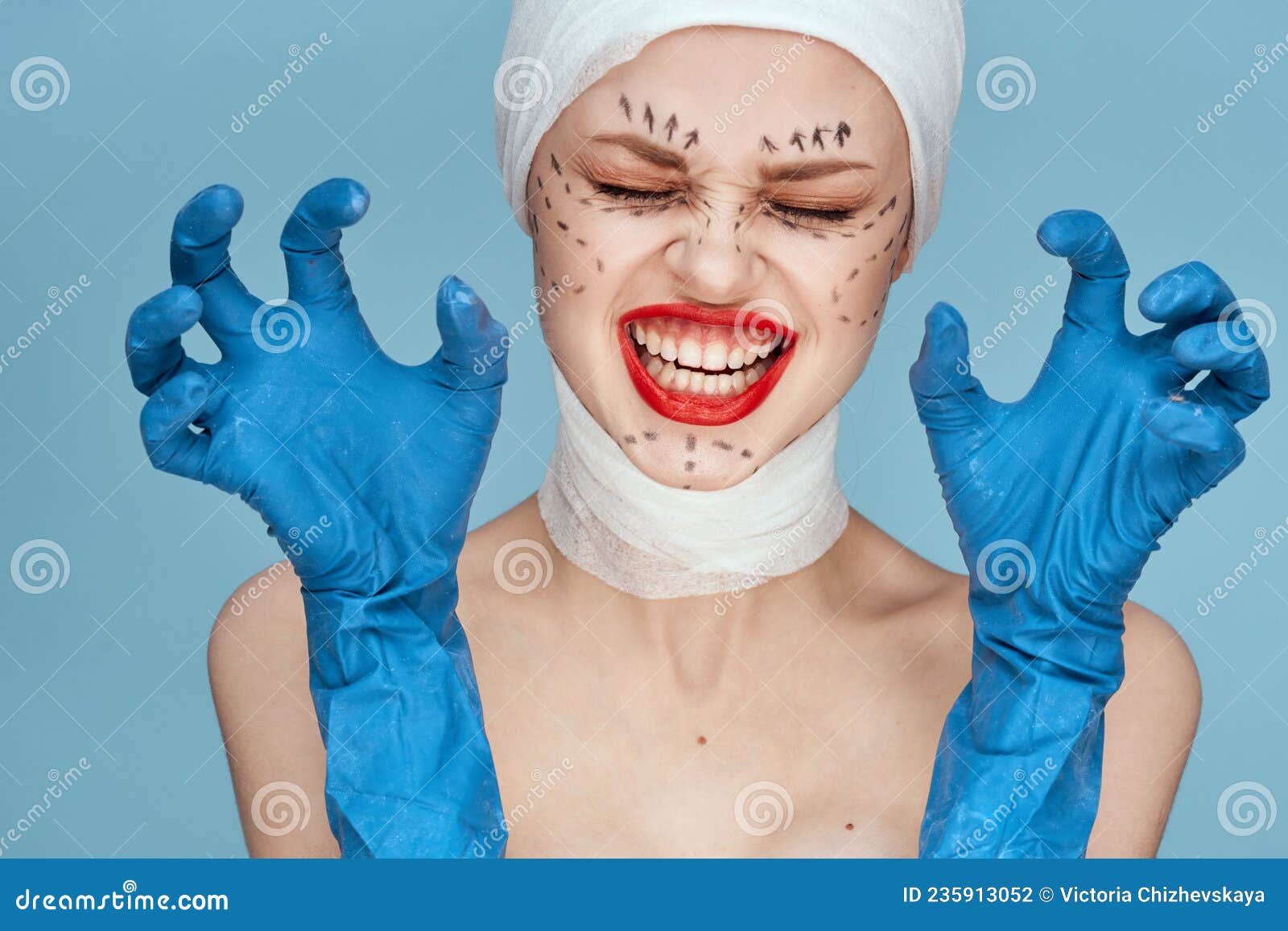Female Patient Posing In Blue Gloves Red Lips Surgery Facial