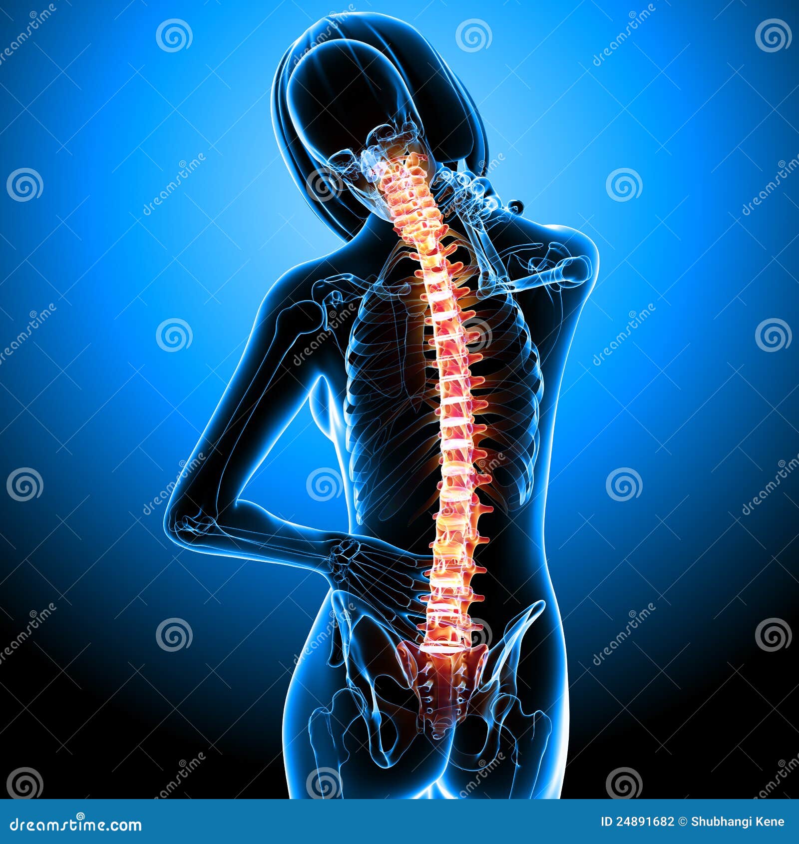 Female Skeleton with Back Pain Stock Illustration - Illustration of ...