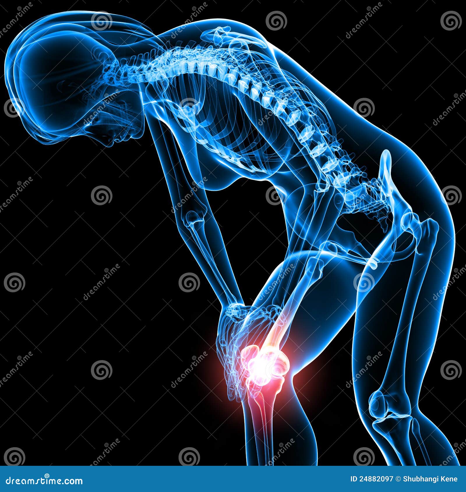 Knee Pain. X-ray Of The Skeleton And Legs. Anatomical Body Of A Seated ...