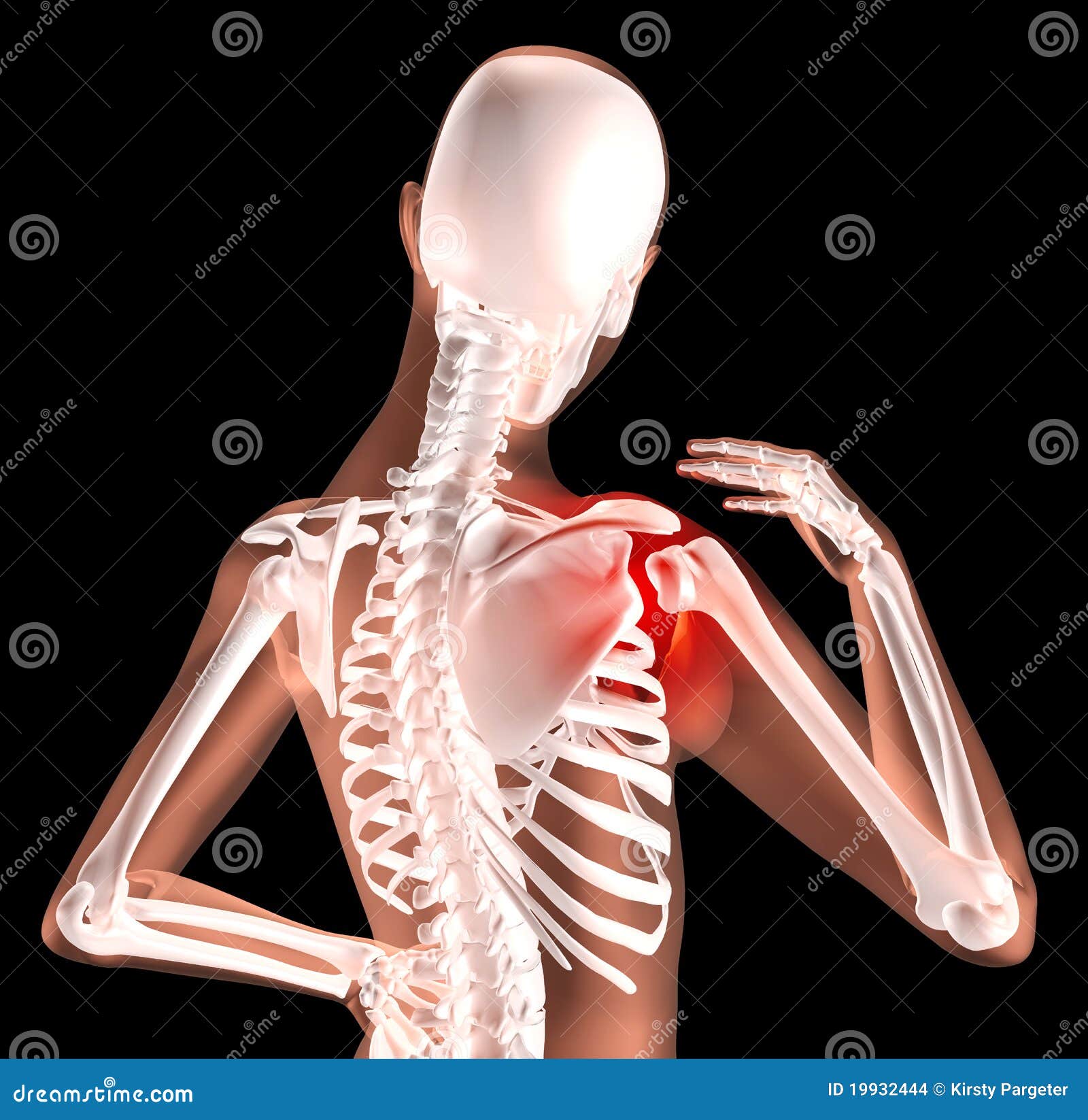 Female Skeleton with Shoulder Pain Stock Illustration - Illustration of ...